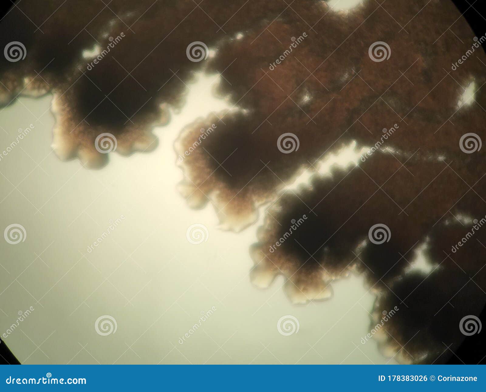 Branched Bacterial Colonies Under the Microscope Stock Photo - Image of ...