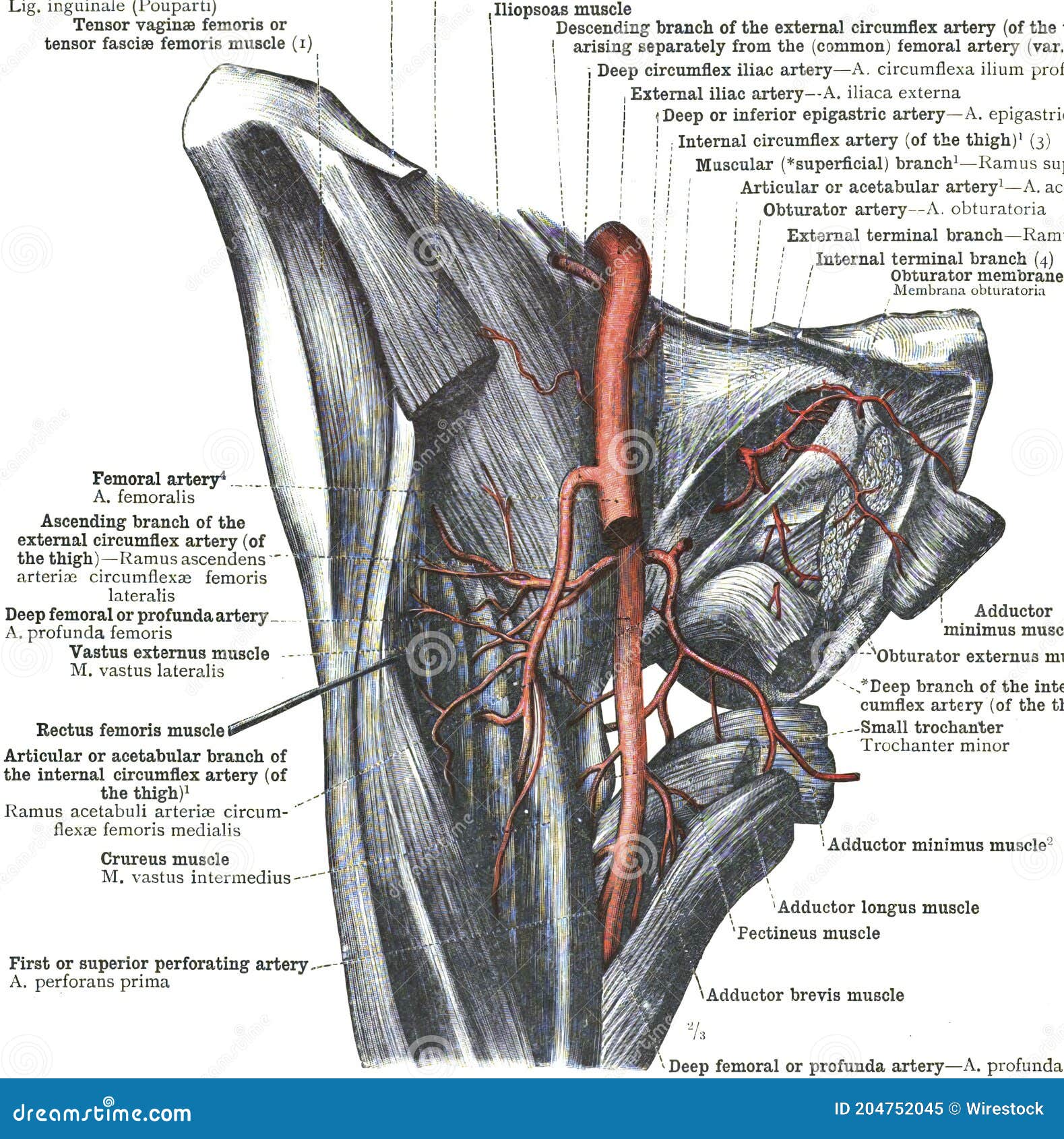 Mra Superficial Femoral Artery Occlusion Collage Royalty-Free Stock ...