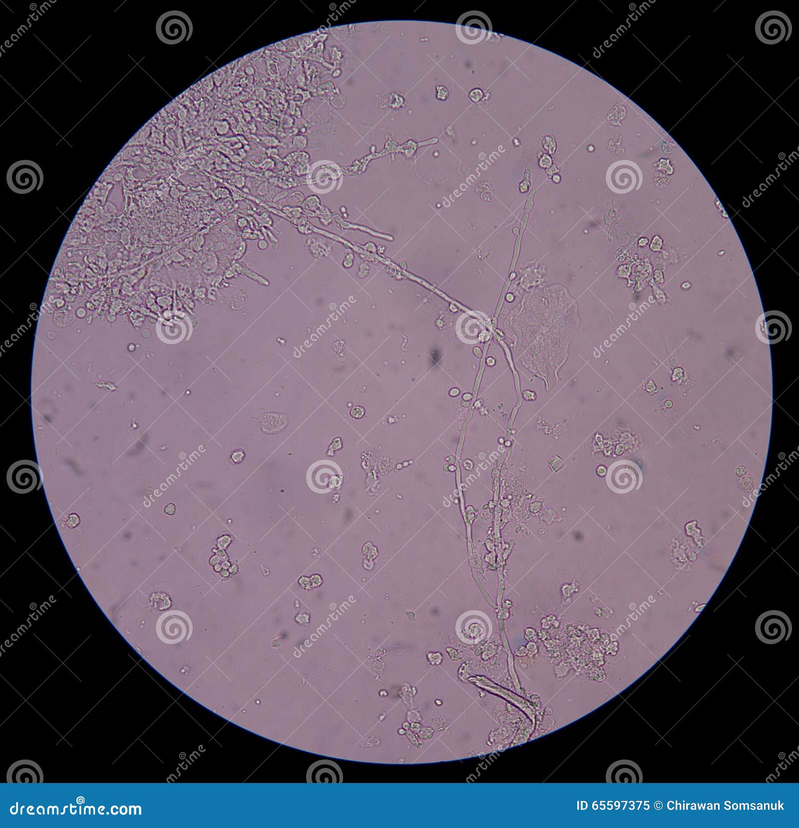 Branching Budding Yeast Cells Stock Image - Image of roundish, baking ...