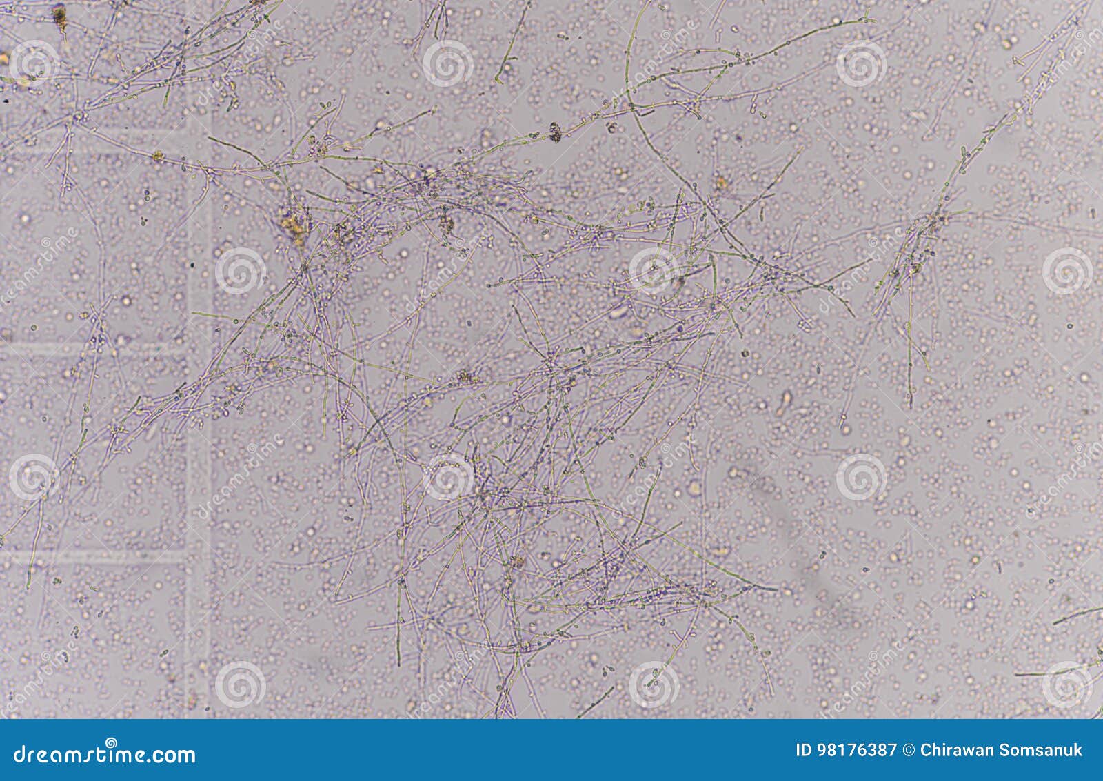 Branching Budding Yeast Cells with Pseudohyphae Stock Image - Image of ...