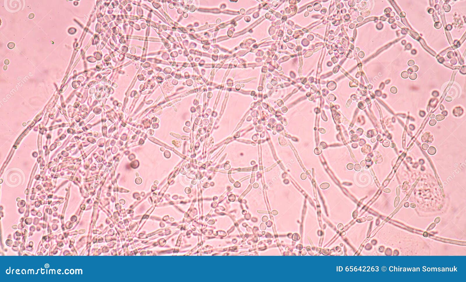 Branching Budding Yeast Cells with Pseudohyphae in Urine Fine W Stock ...
