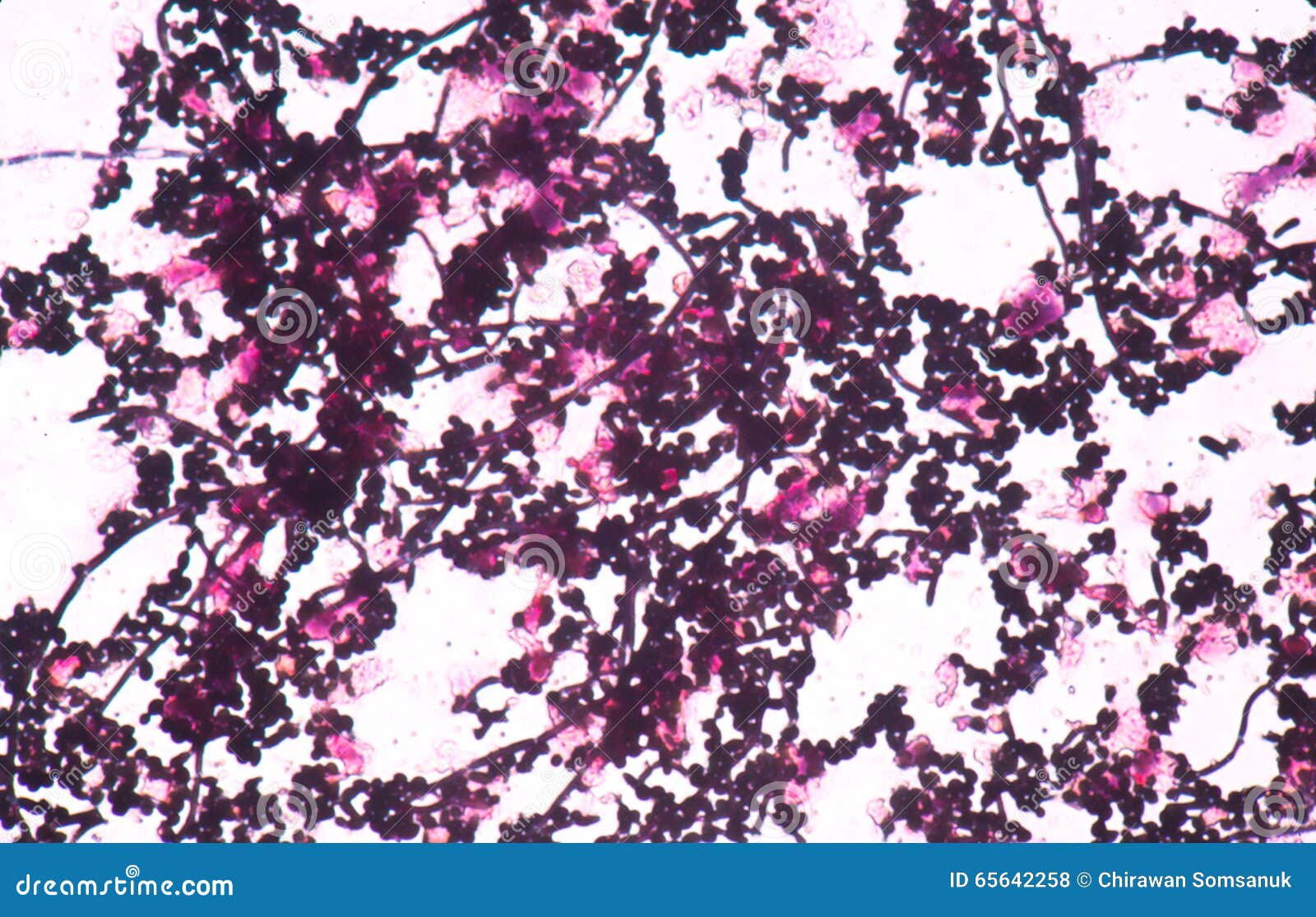 Branching Budding Yeast Cells with Pseudohyphae in Urine Gram St Stock ...