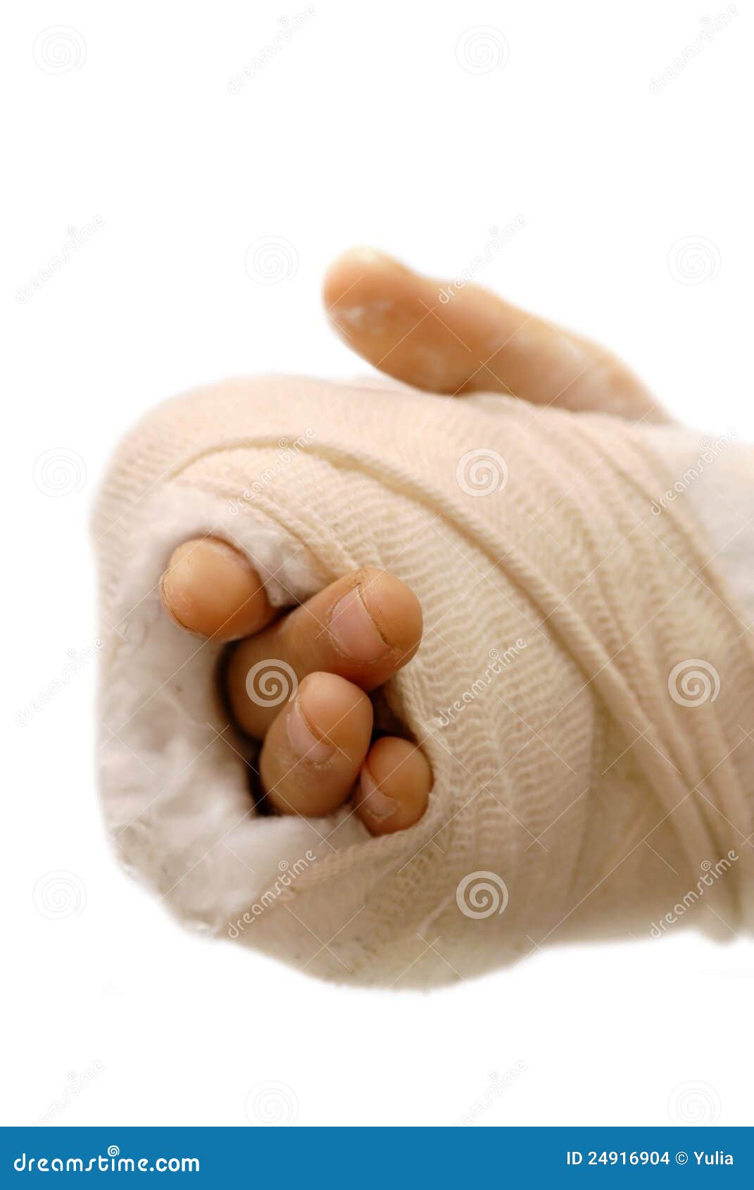 Bras Cassé Photo Stock Image Du Invalidez Bandage Fuselage 24916904