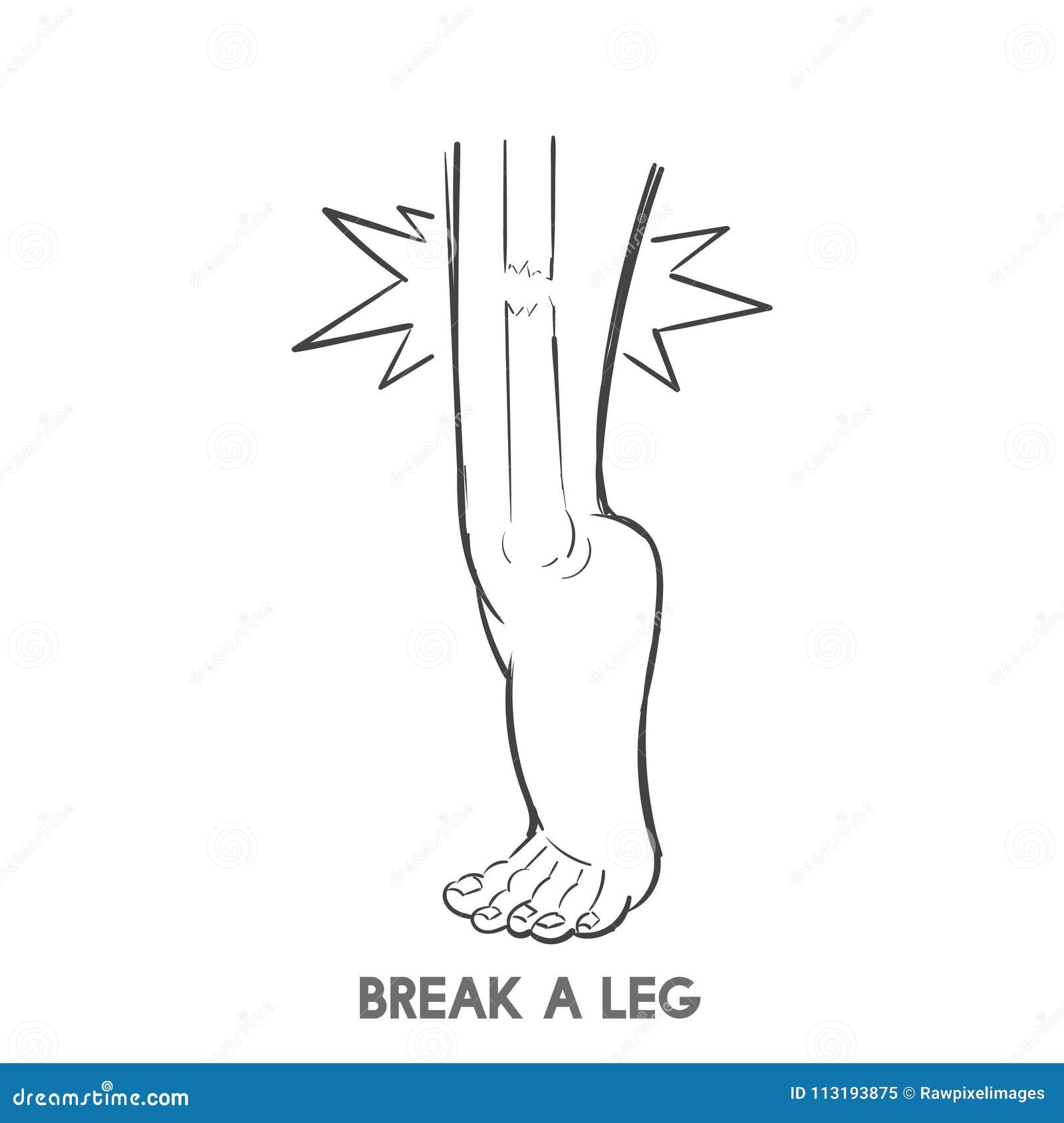 Break a leg hand drawn stock illustration. Illustration of ijury ...