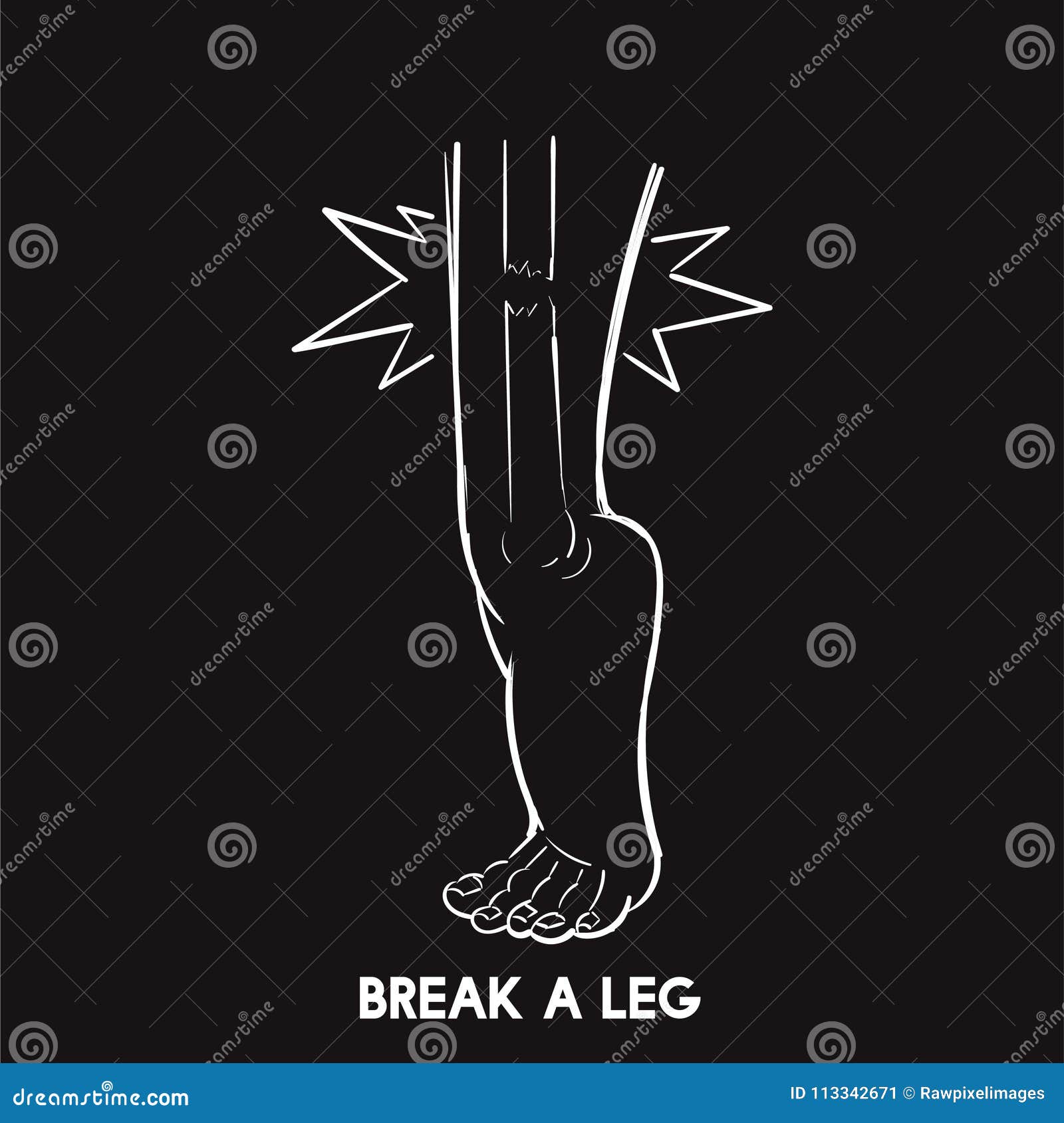 Break a Leg Idiom Illustration Stock Illustration - Illustration of ...