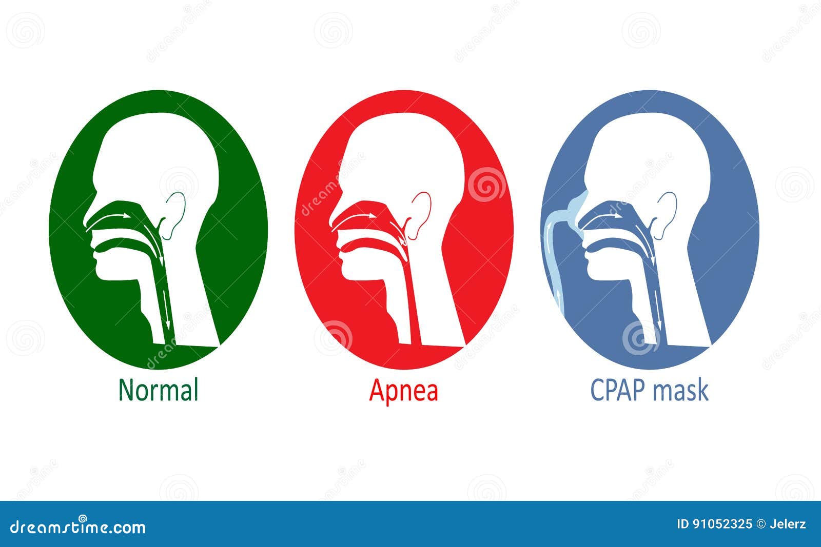 Breathing with Apnea Process Stock Vector - Illustration of cure, nasal ...