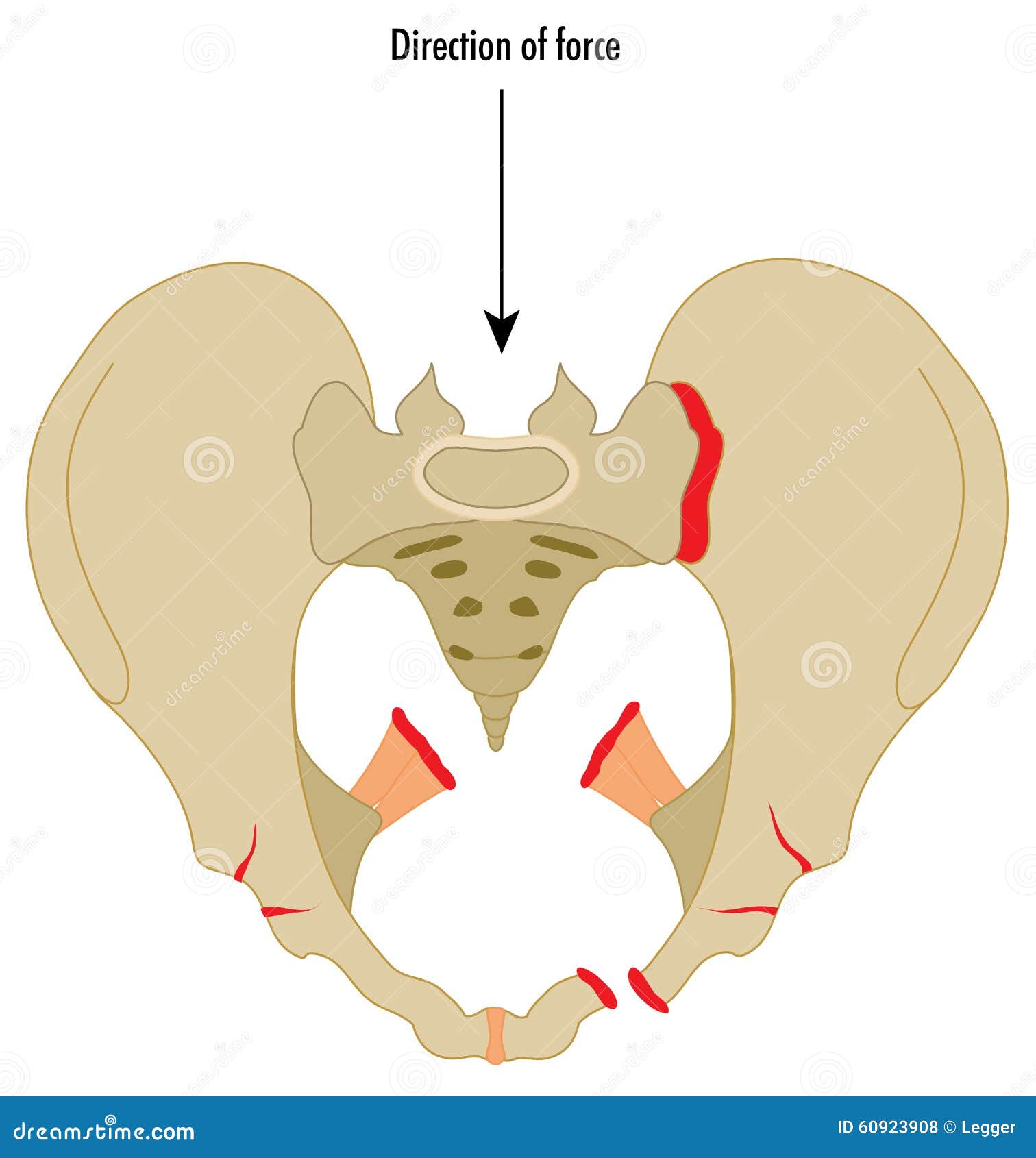 Breuk van het bekken vector illustratie. Illustration of gezondheid ...