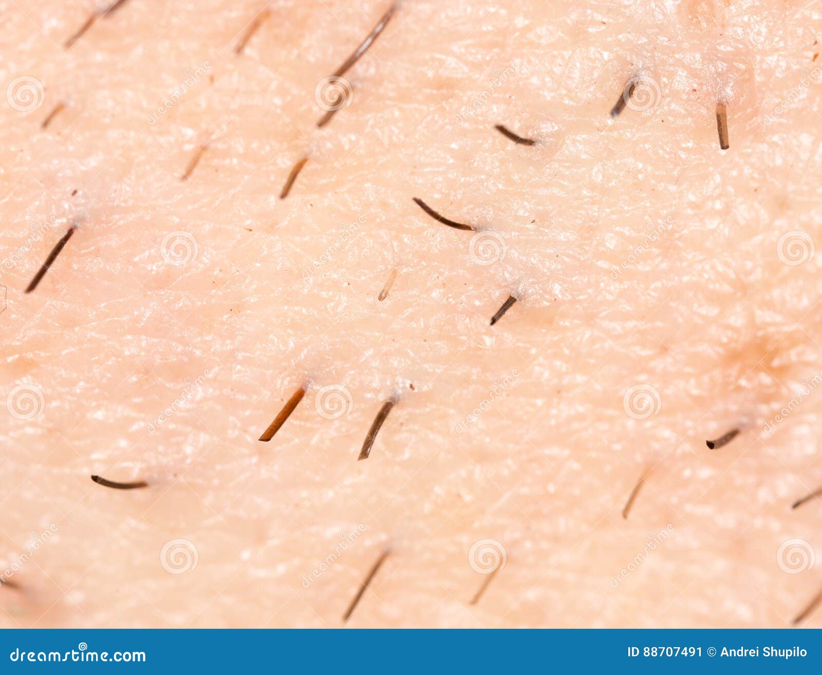The Bristles on the Skin. Macro Stock Image - Image of stubble, color ...