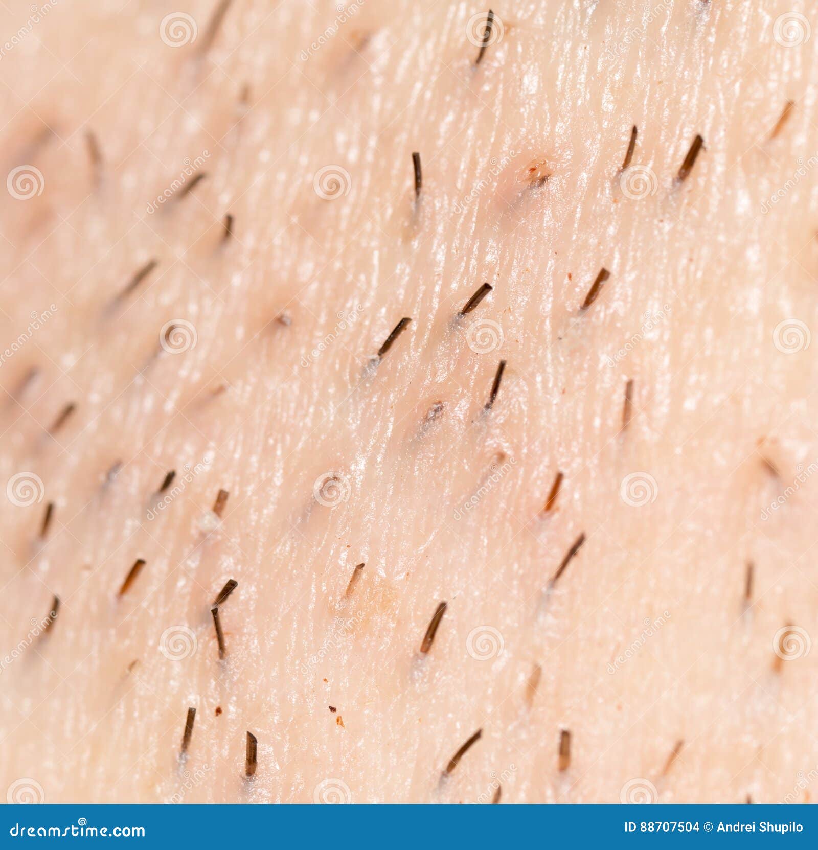 The Bristles on the Skin. Macro Stock Photo - Image of dark, studio ...