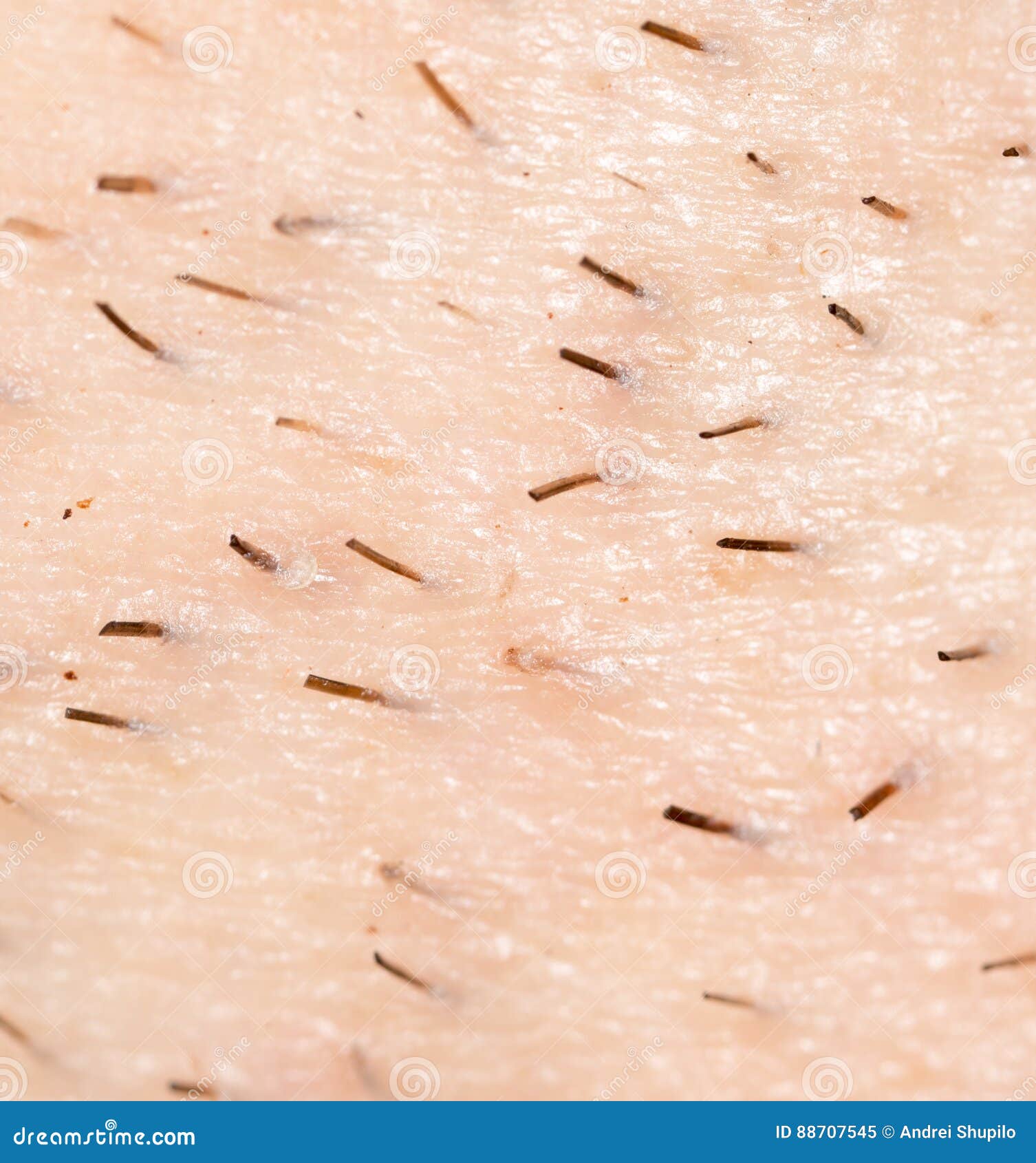 The Bristles on the Skin. Macro Stock Image - Image of straggly ...