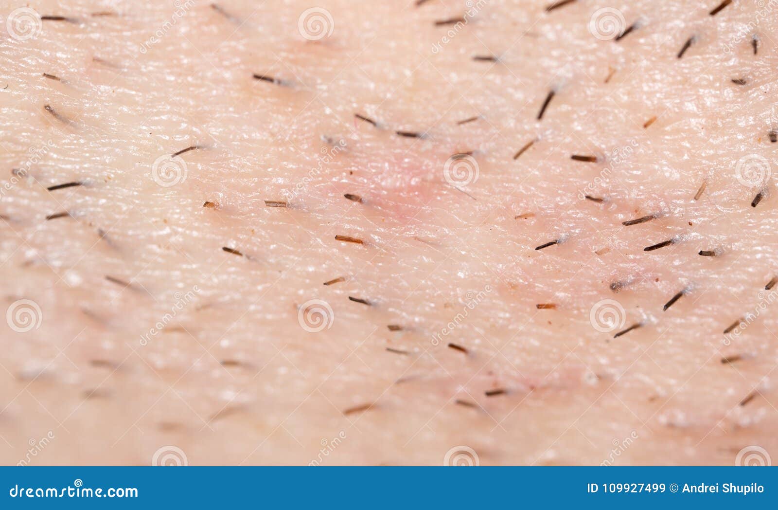 The Bristles on the Skin. Macro Stock Image - Image of macro, skin ...