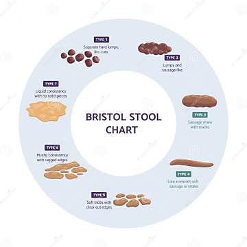 Bristol Stool Chart Infographic, Flat Vector Illustration Isolated on ...