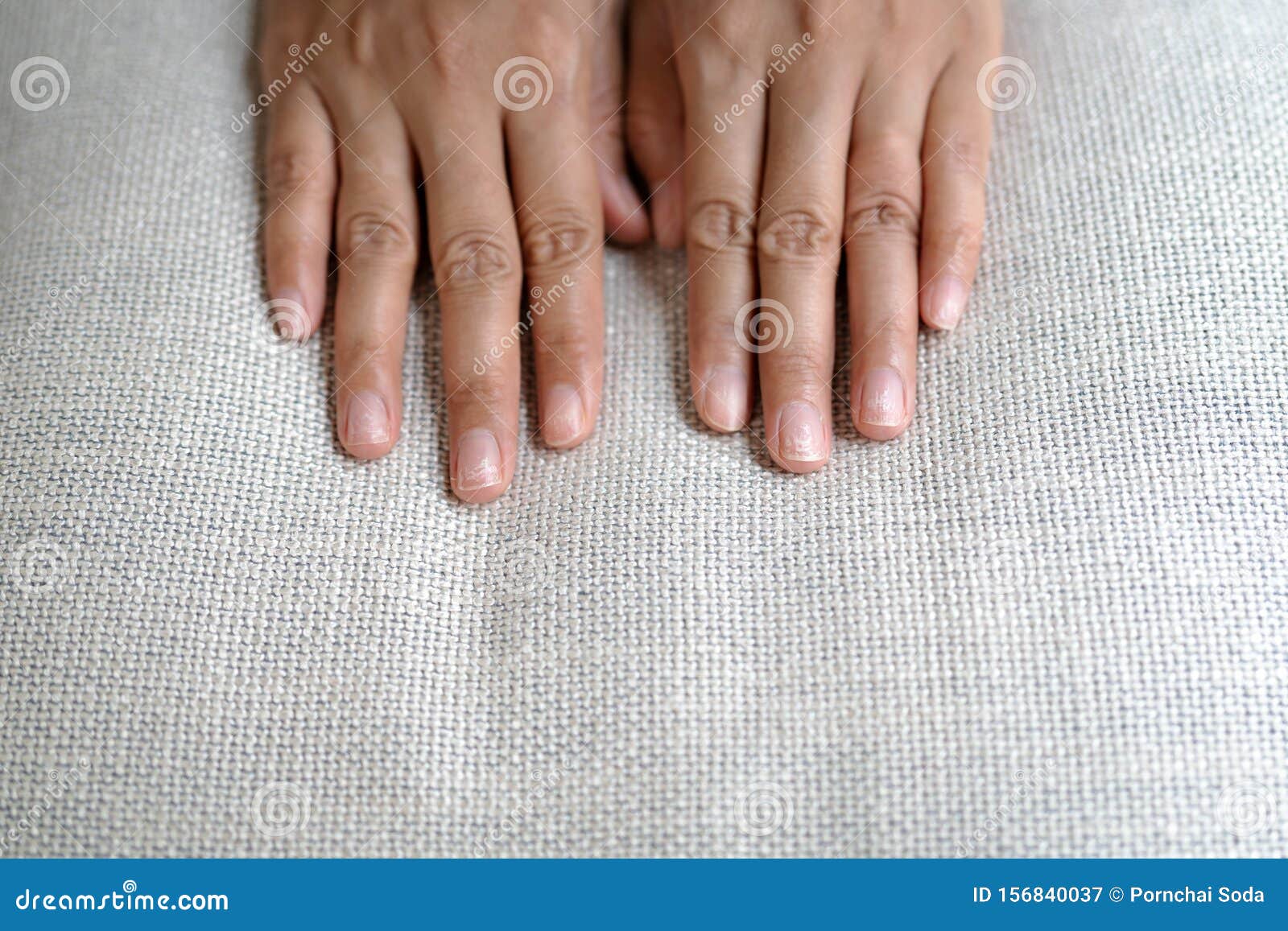 Damaged Nails On Hand From Biting And Dermatillomania/compulsive Skin ...