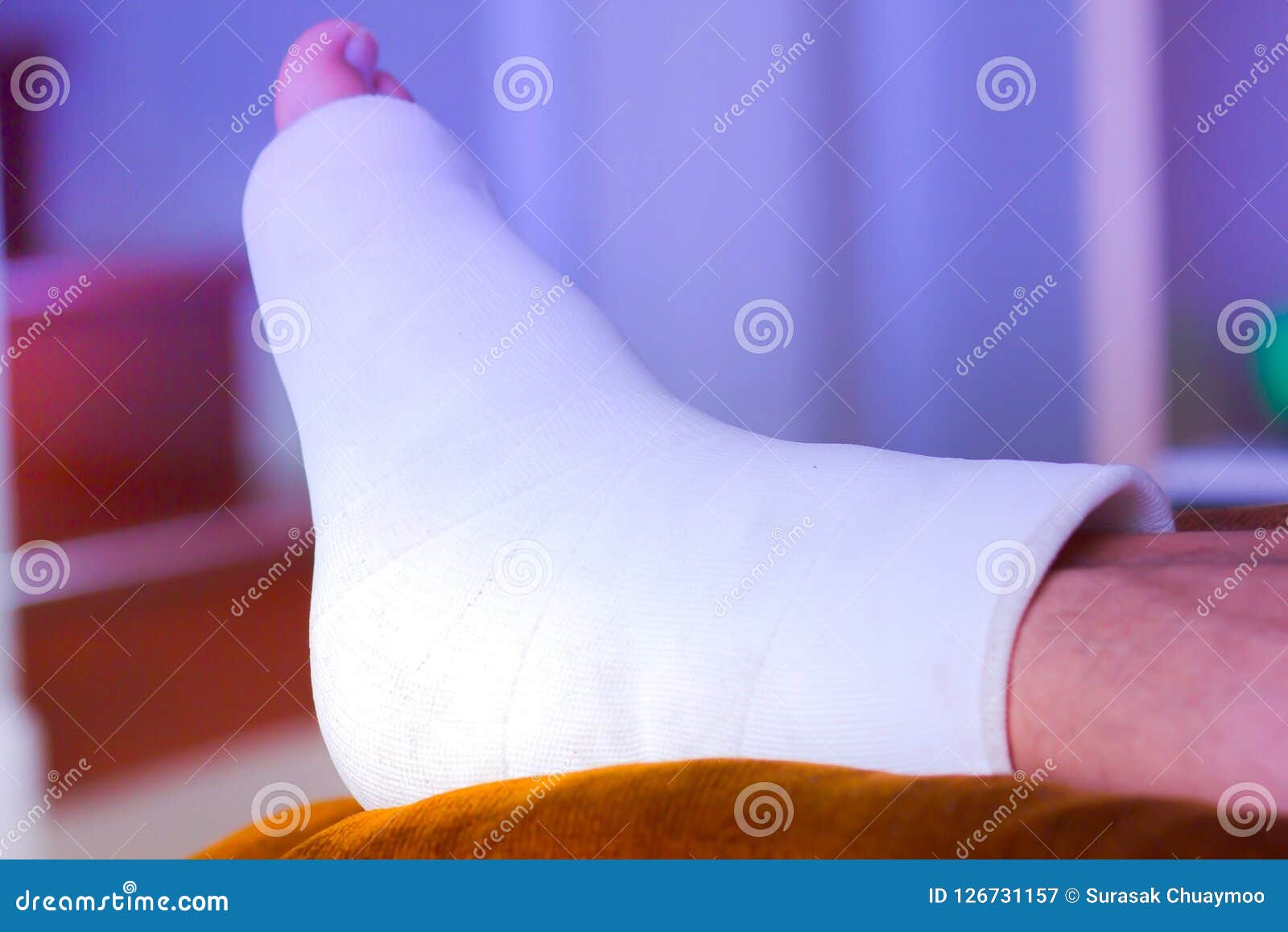 Broken ankle stock image. Image of surgery, ankle, broken - 126731157