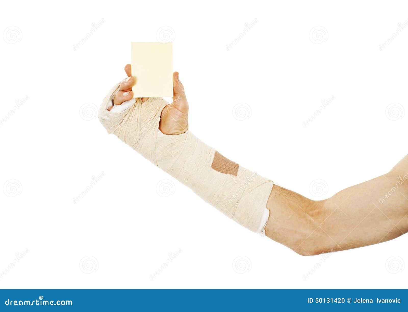 Broken Arm Bone in Cast Holding a Blank Card Stock Photo - Image of ...
