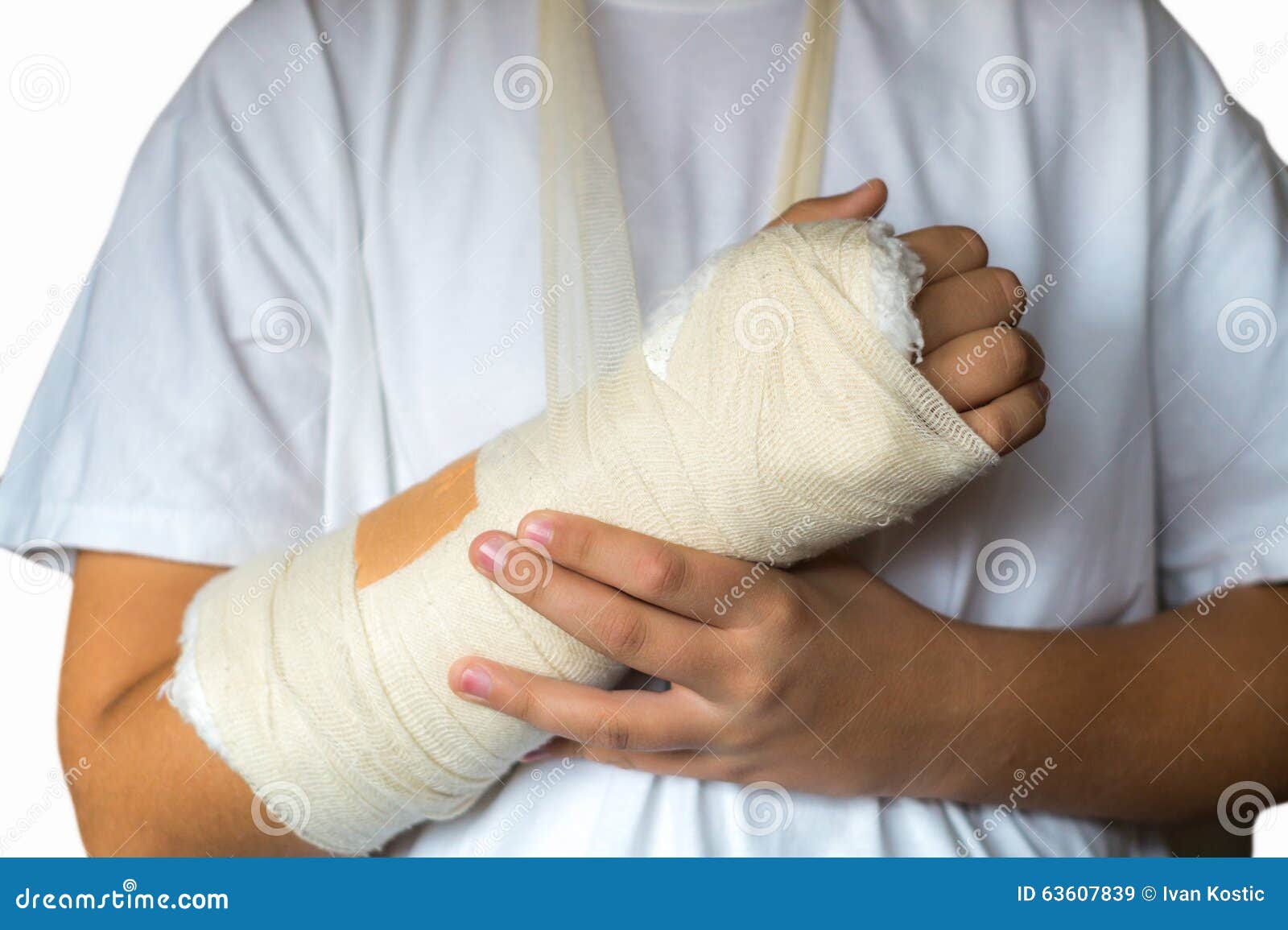 Broken Arm stock image. Image of limb, diagnosis, life - 63607839