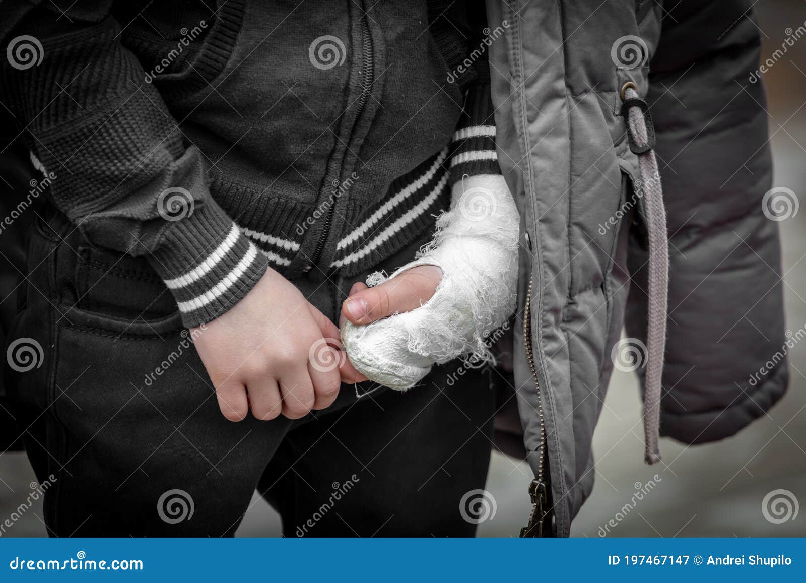 Broken Arm in a Cast and Bandage Stock Image - Image of doctor, bandage ...