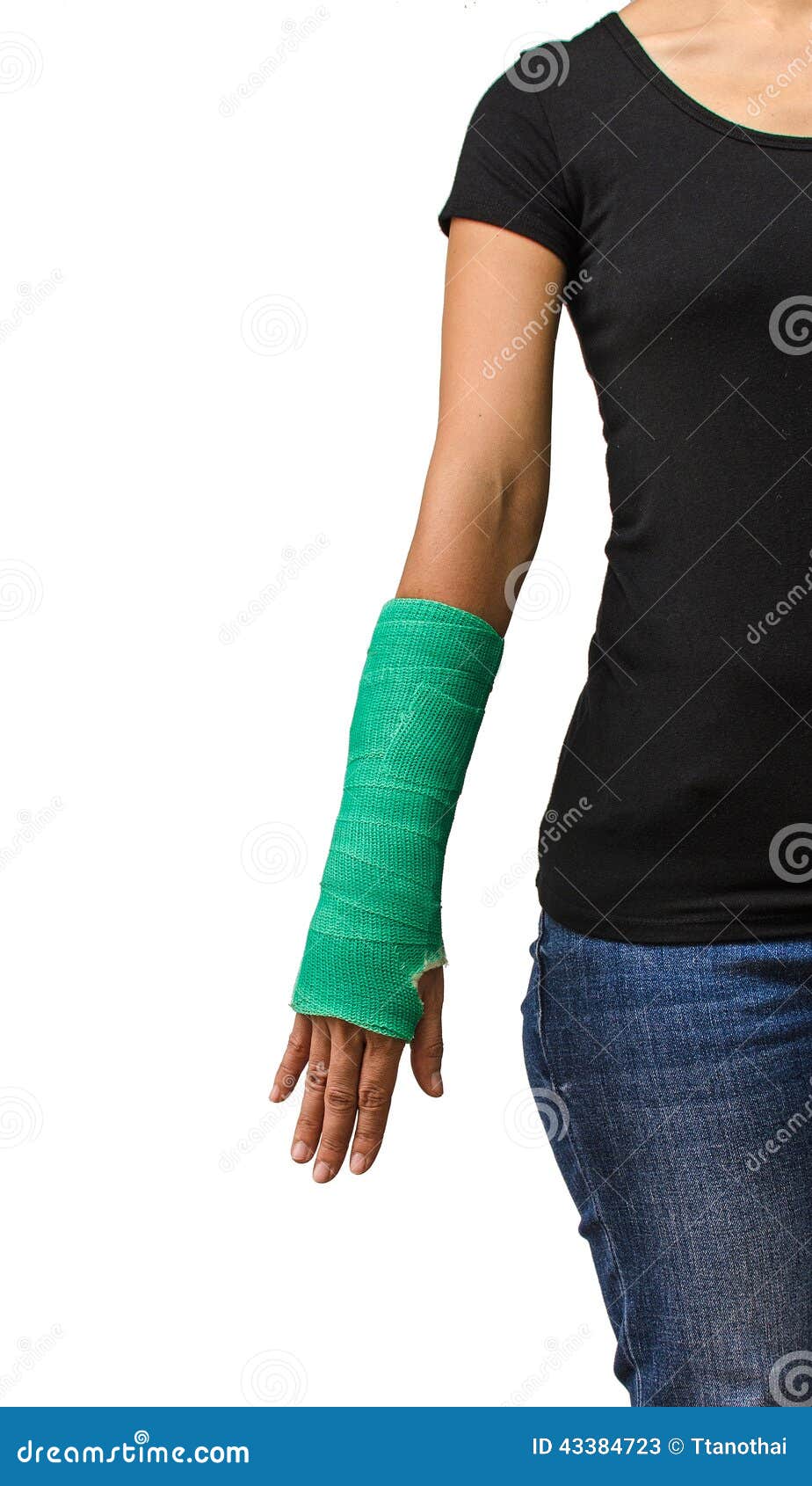 Green Arm Cast