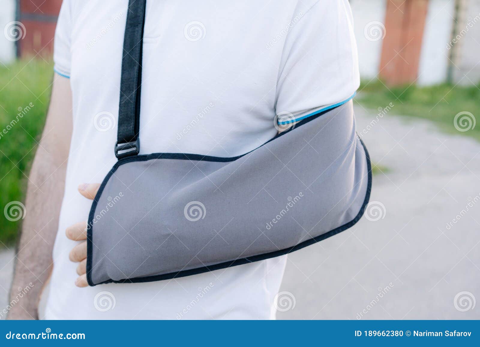 Broken Arm of a Man in a Cast Stock Photo - Image of health, injury ...