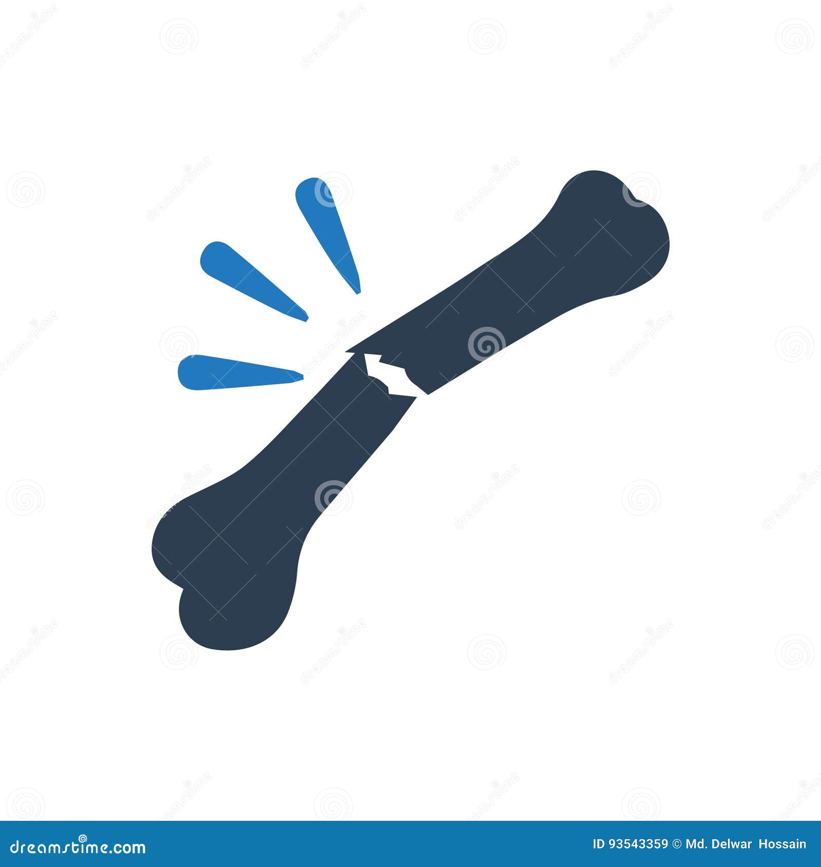 X-ray Of Broken Leg, Bone Fixed With Medical Implantable Plate Line ...