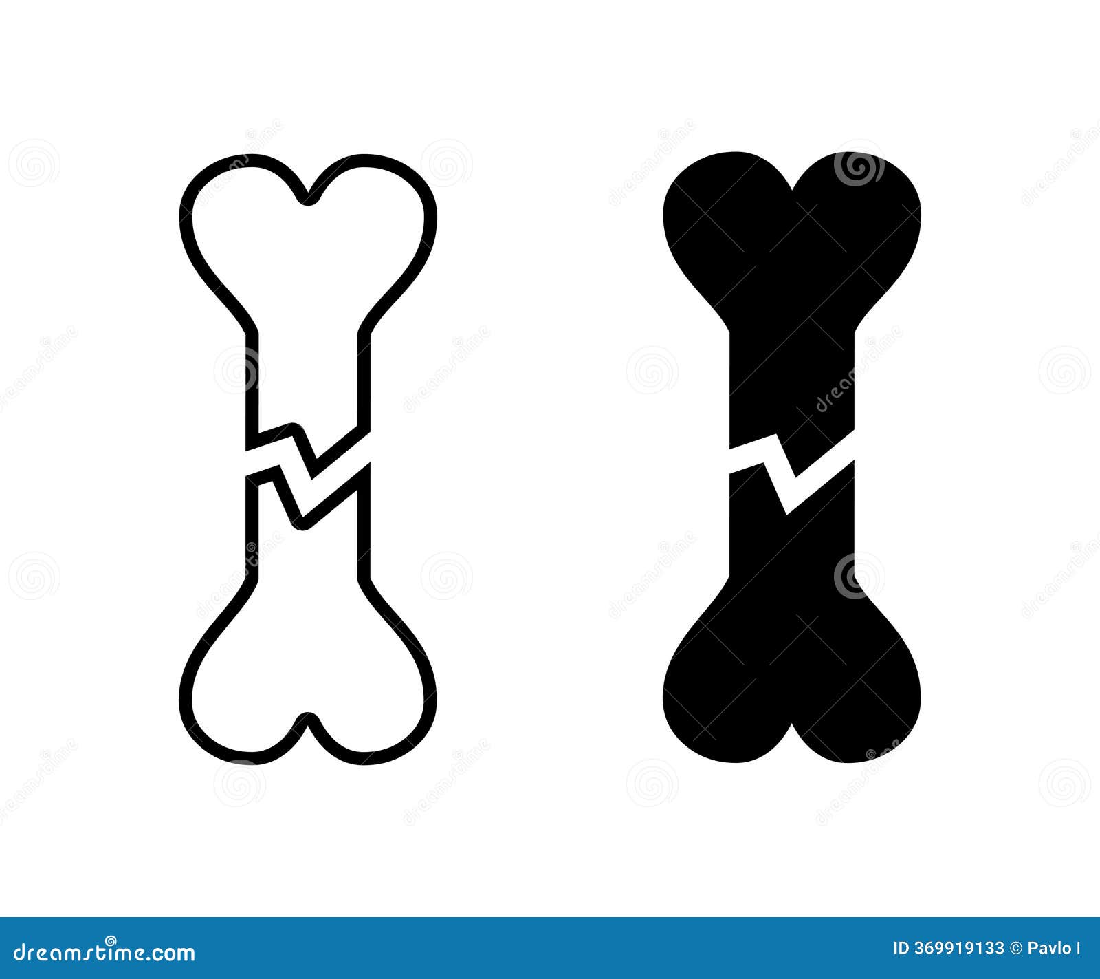 X-ray Of Broken Leg, Bone Fixed With Medical Implantable Plate Grey ...