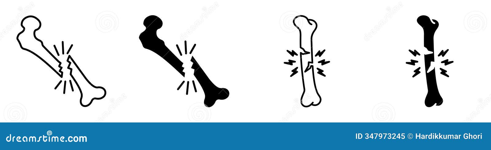 Broken Arm, Bone Fracture, Trauma, Orthopedic Plaster Cast. Sketch ...