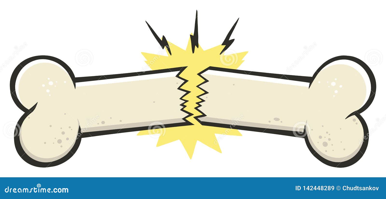 Broken Arm, Bone Fracture, Trauma, Orthopedic Plaster Cast. Sketch ...