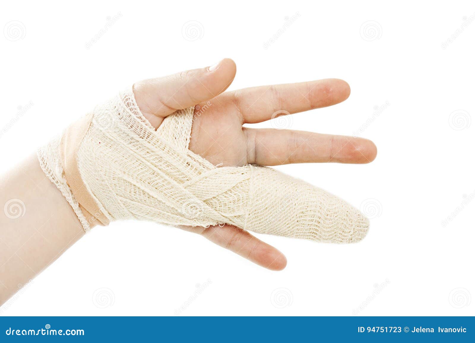 Broken Child Hand Or Arm With Plaster Due To Bone Fracture On White ...