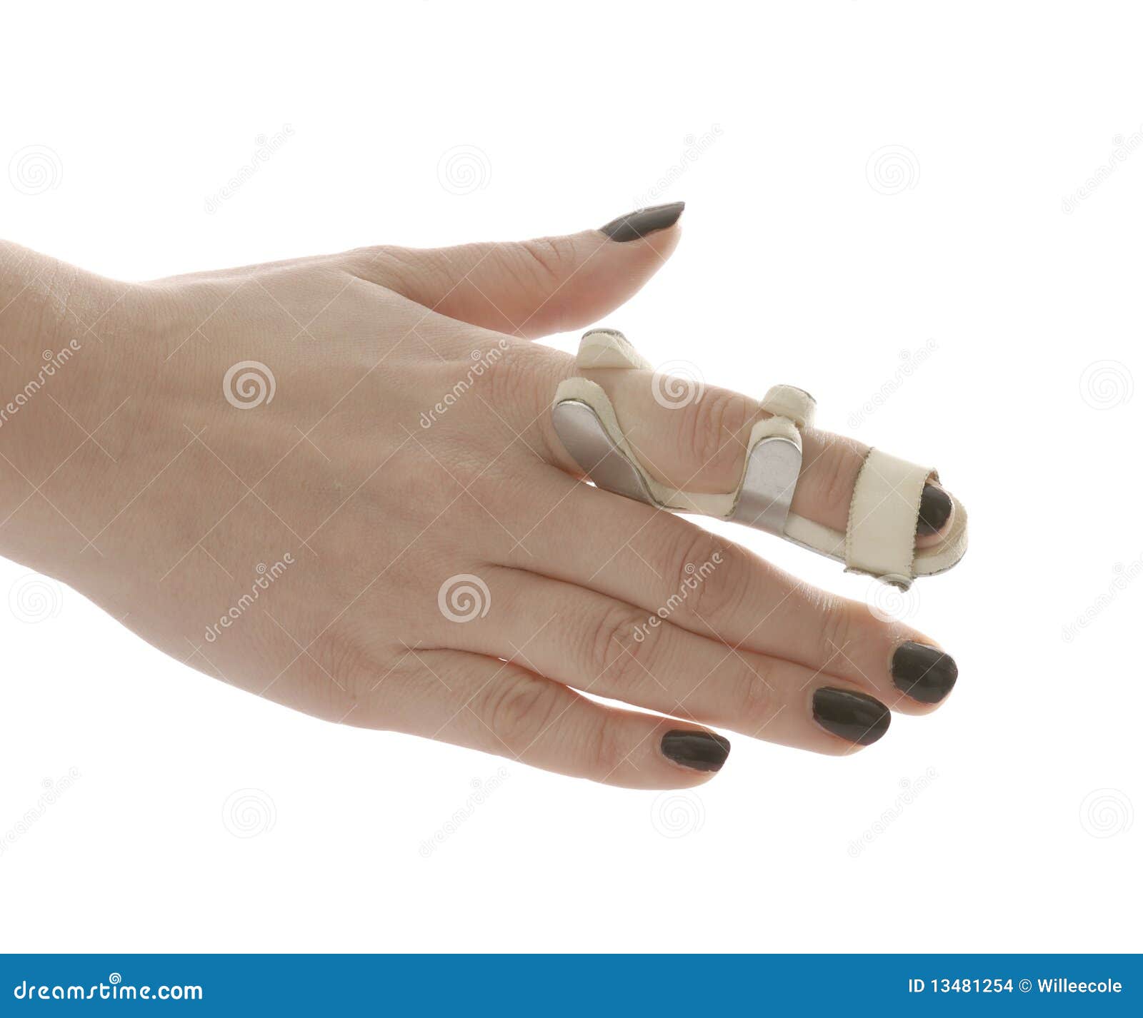 Broken Finger In A Splint Royalty-Free Stock Photo | CartoonDealer.com ...