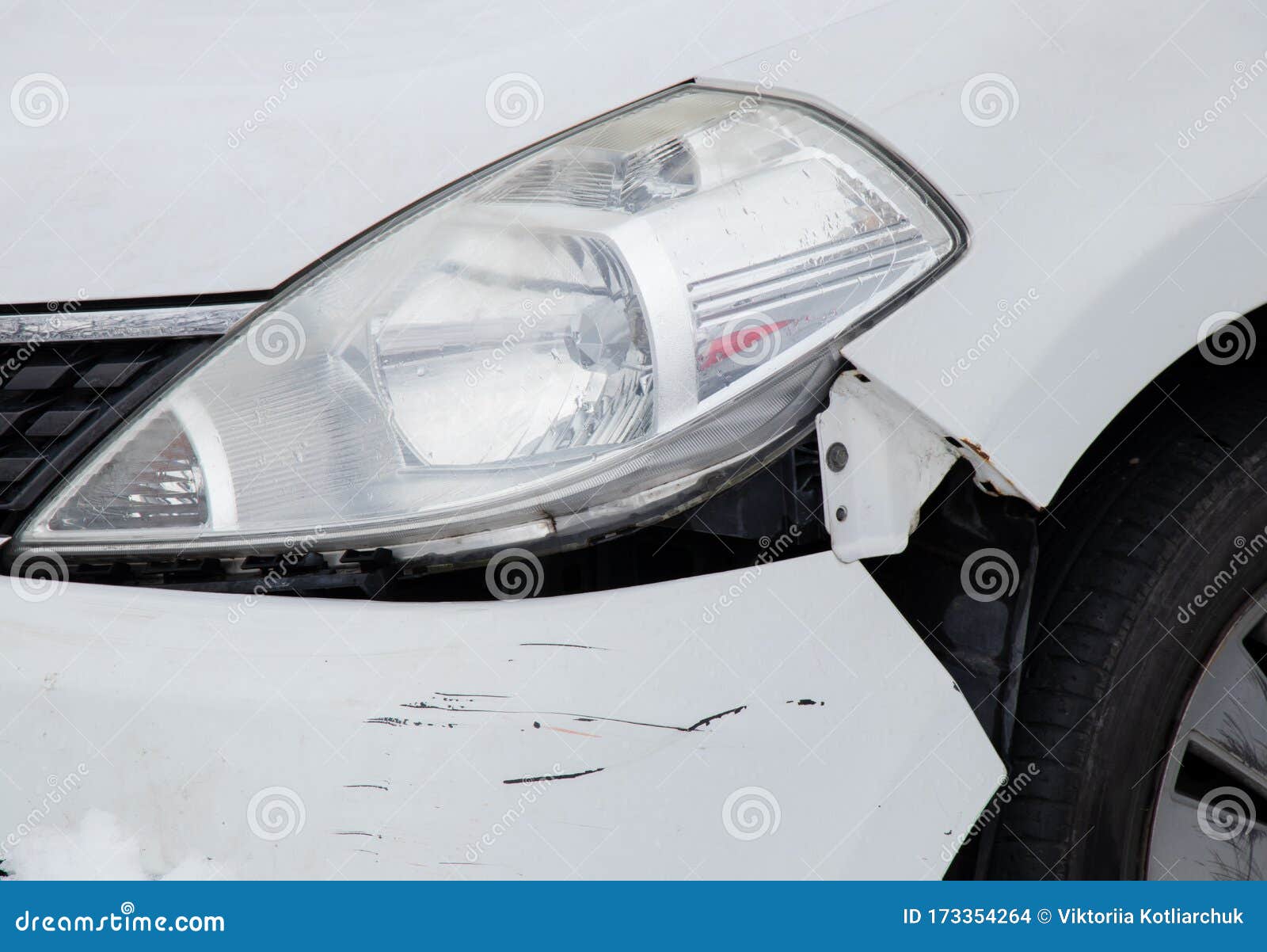 Broken Front Teeth Of A Little Girl. Little Girl`s Smile. 6 Year Old ...