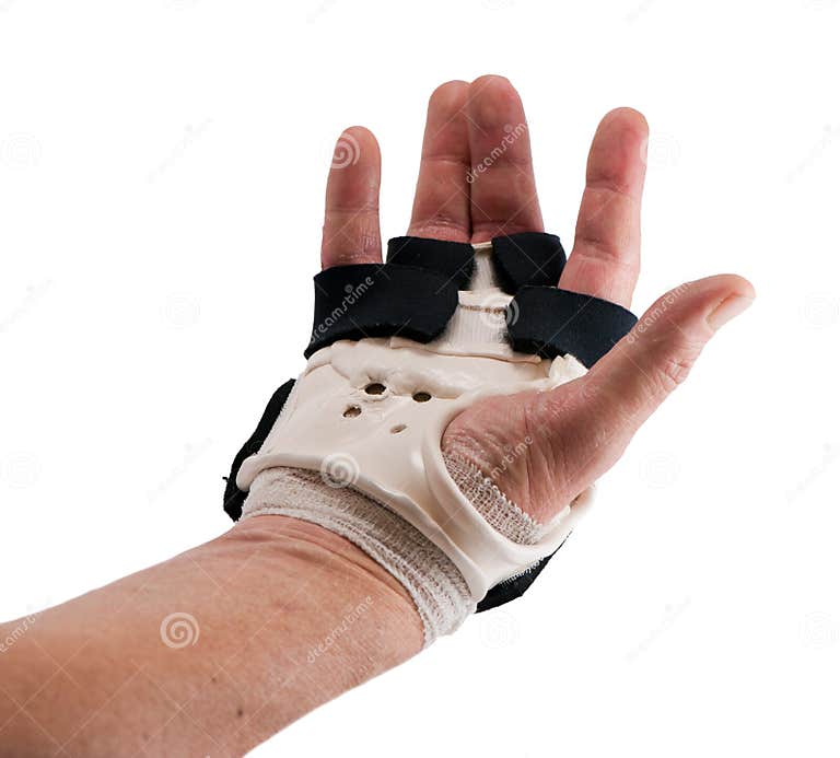 Broken Hand stock image. Image of recovery, orthopaedic - 21049313