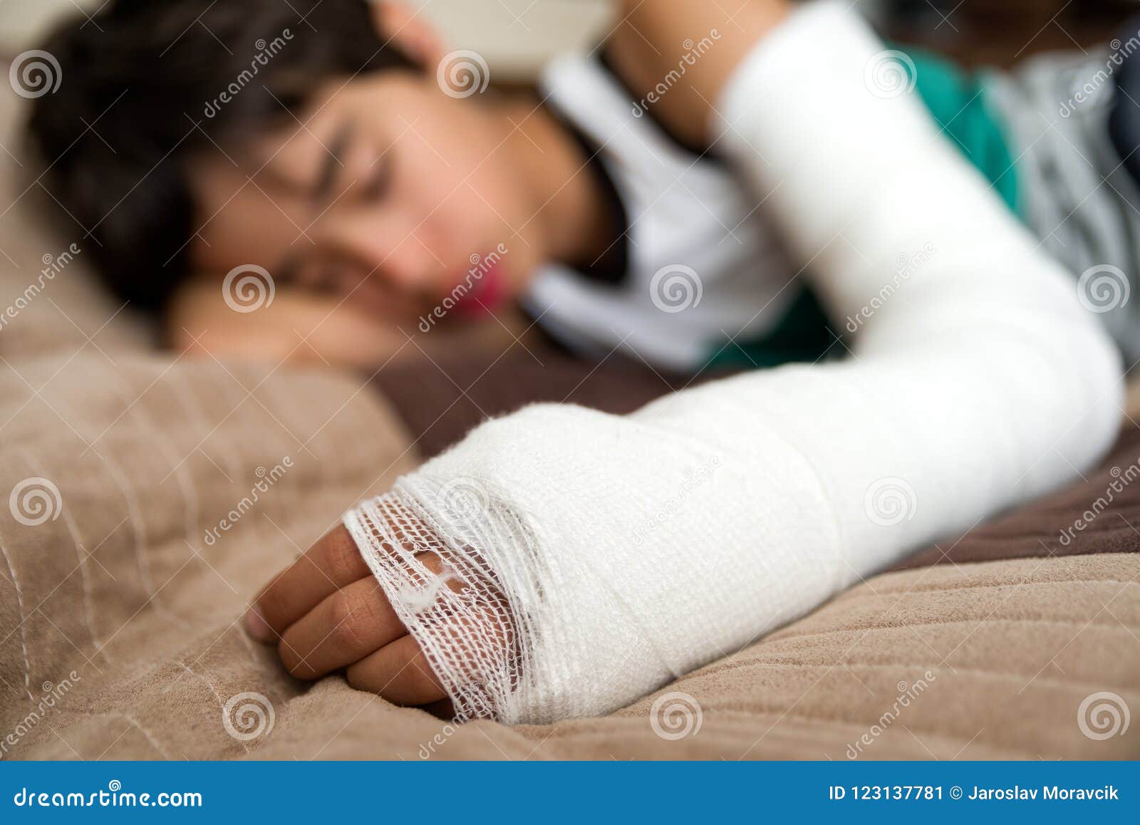 Broken hand in cast stock image. Image of plaster, hurt - 123137781