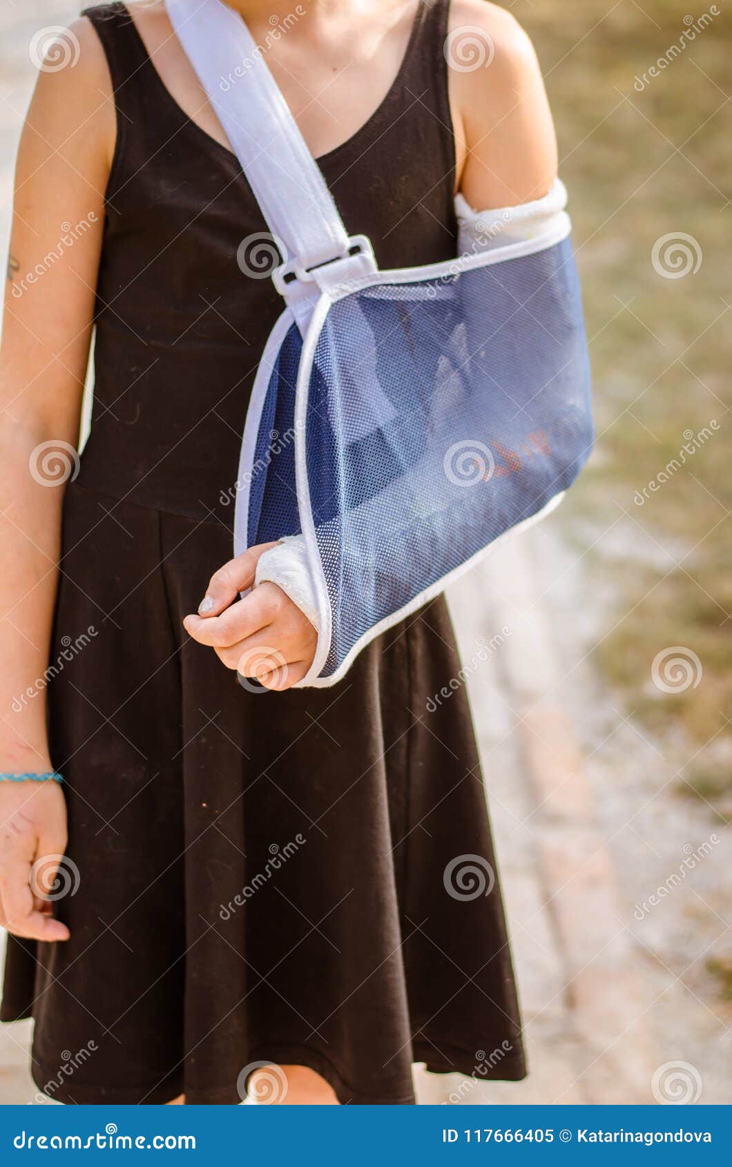 Wounded broken shoulder stock image. Image of healing - 117666405