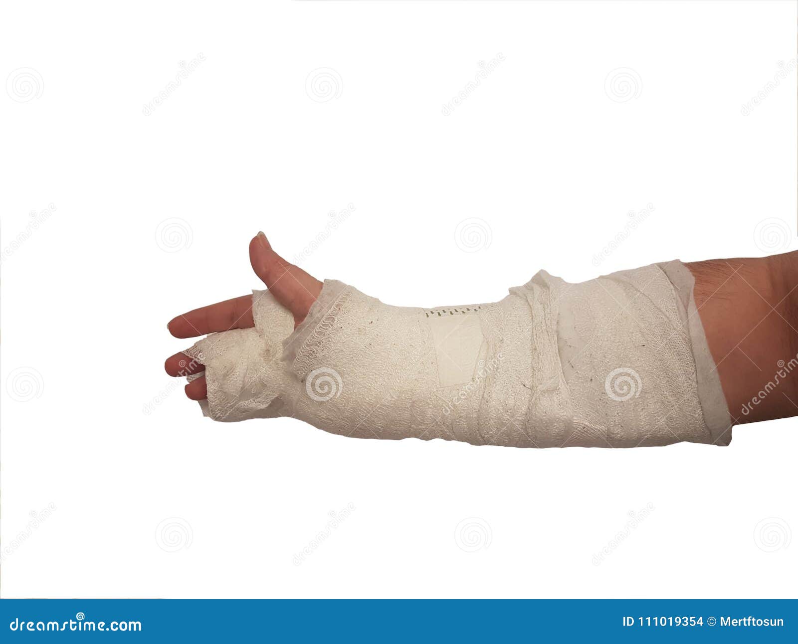 Broken Hand Plaster. Right Hand. Male. Isolated Stock Photo - Image of ...