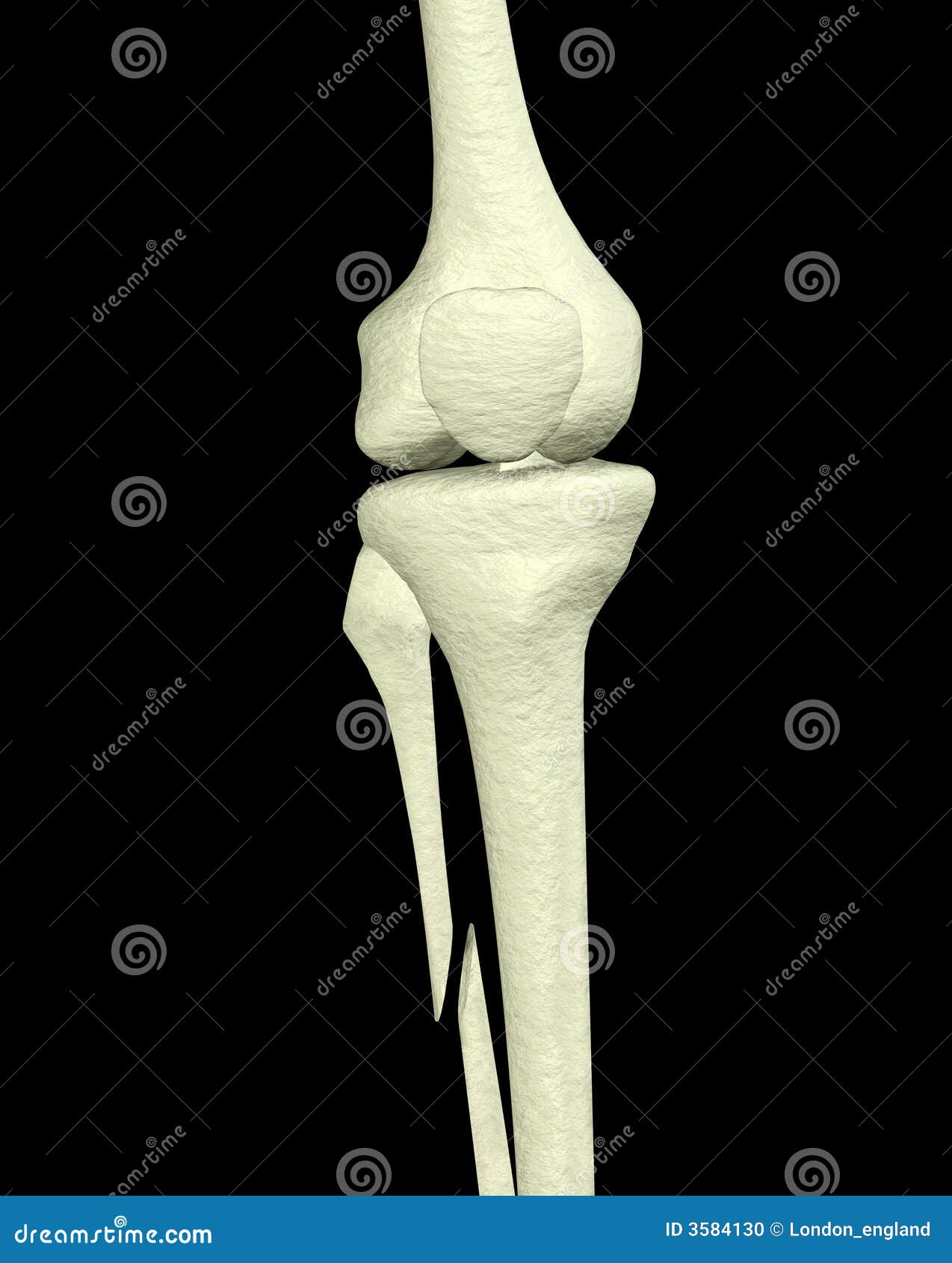 A Broken Tibia Stock Illustration | CartoonDealer.com #157583551