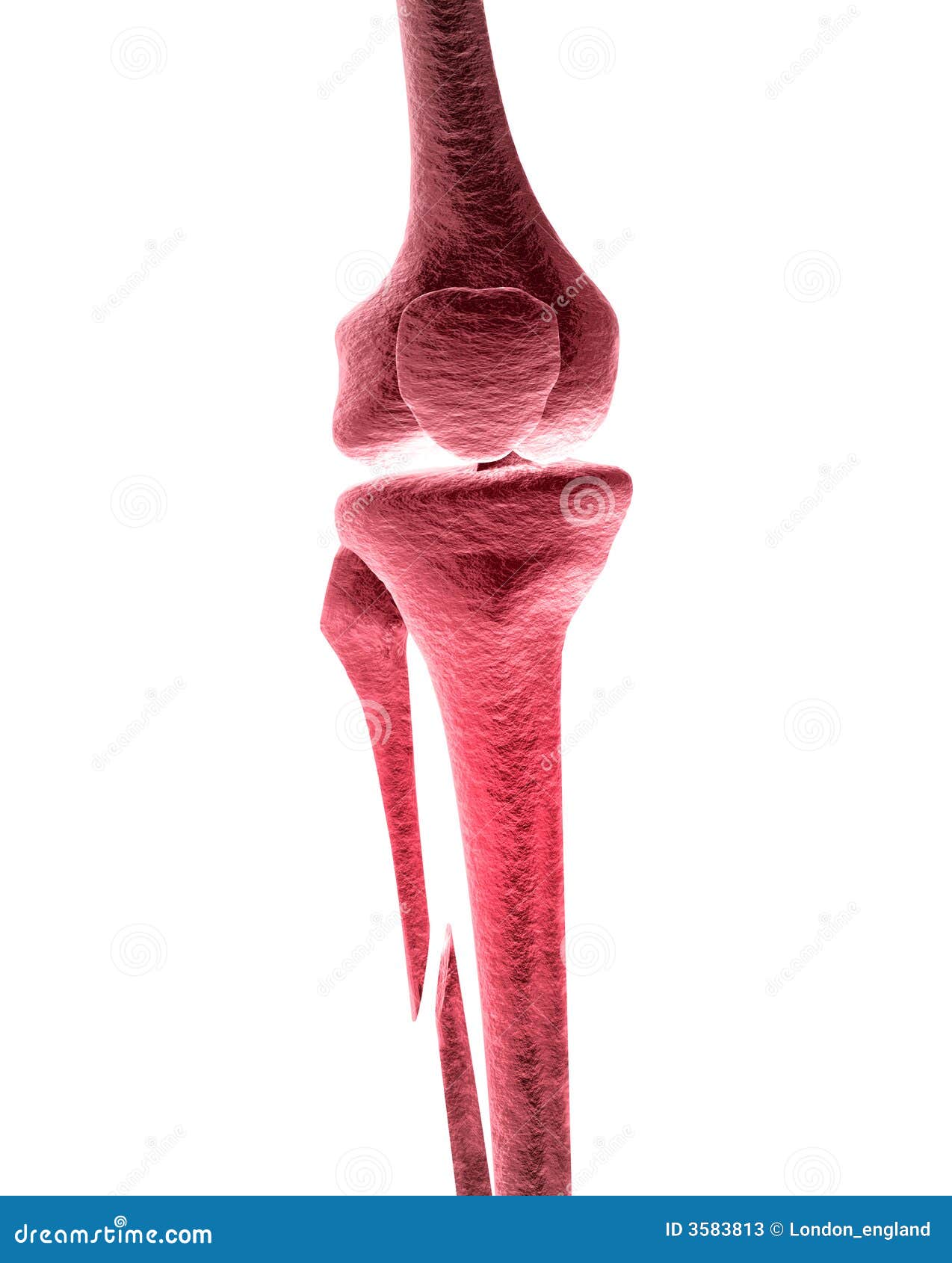 A Broken Tibia Stock Illustration | CartoonDealer.com #157583551