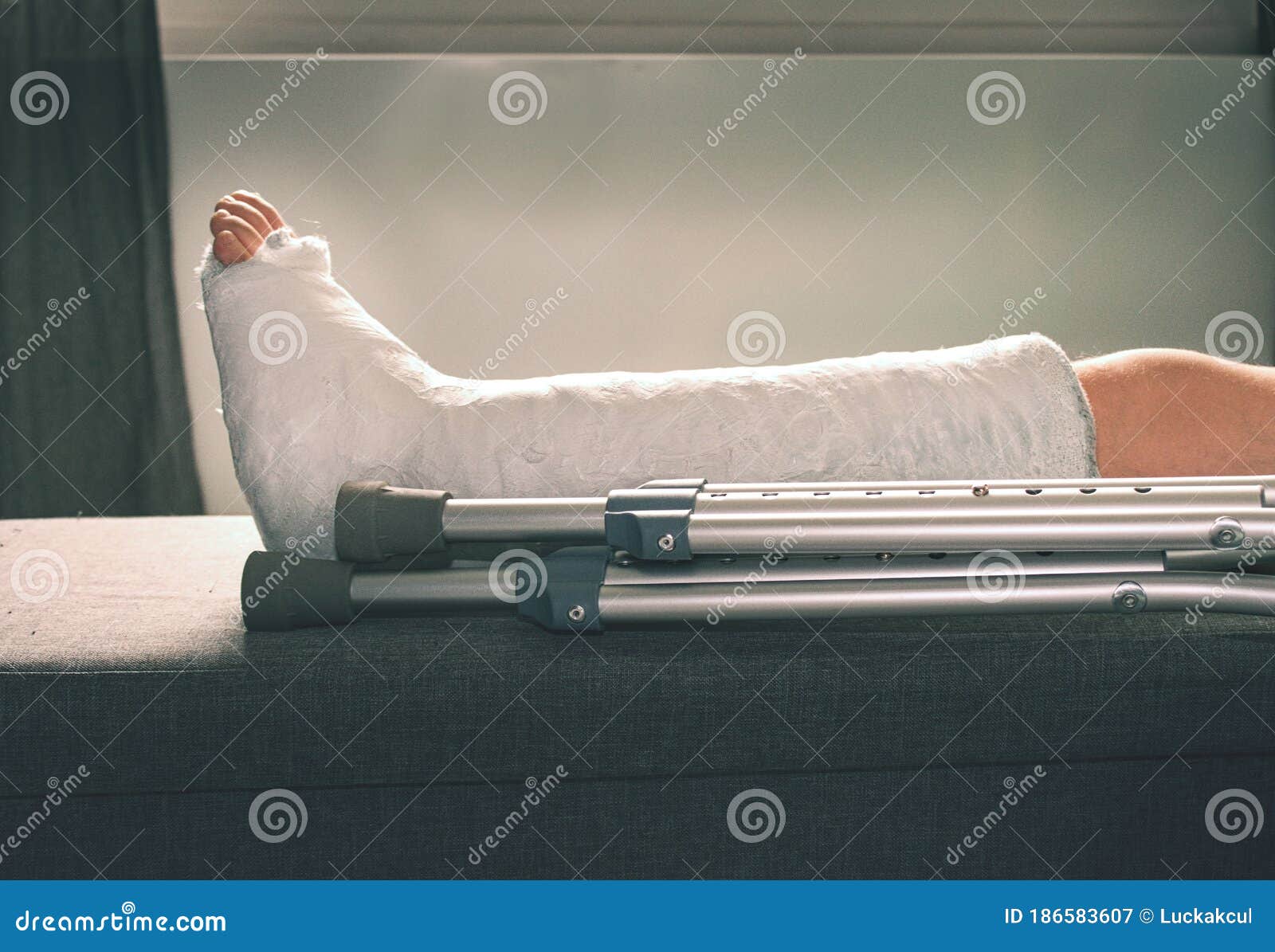 Detail Left Leg or in White Plaster Placed on a Gray Sofa or Stool ...