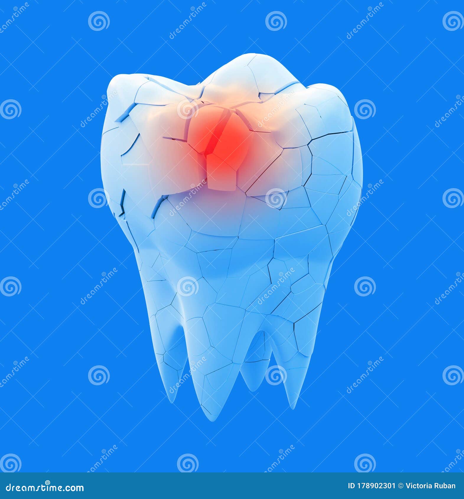 Broken Molars Tooth and Whole Tooth Isolated on White Background Stock ...