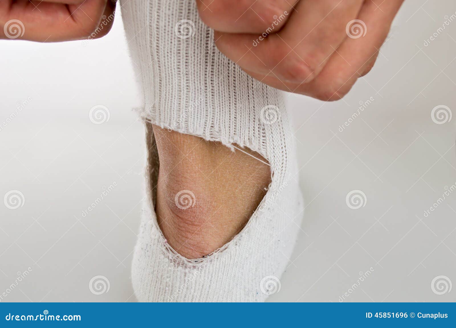 Broken sock stock photo. Image of poor, foot, dress, material - 45851696
