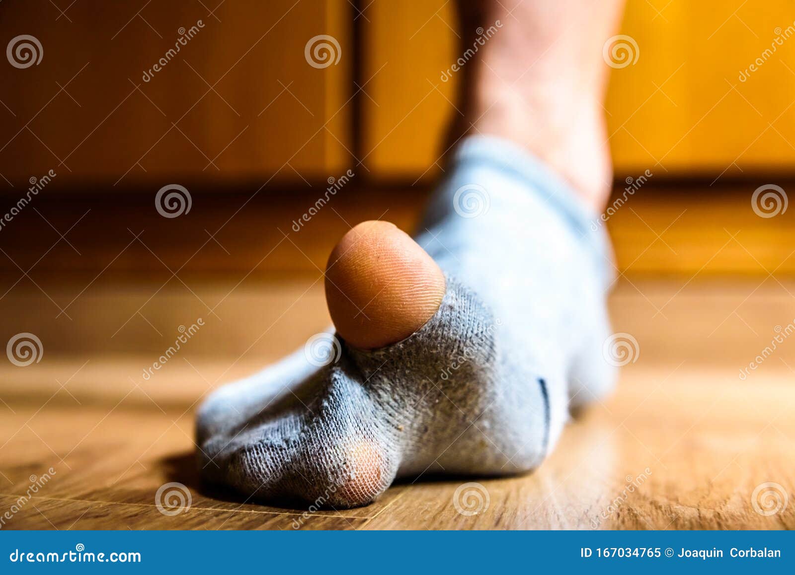 Broken Sock with a Hole in a Man`s Big Toe, Concept of Poverty during ...