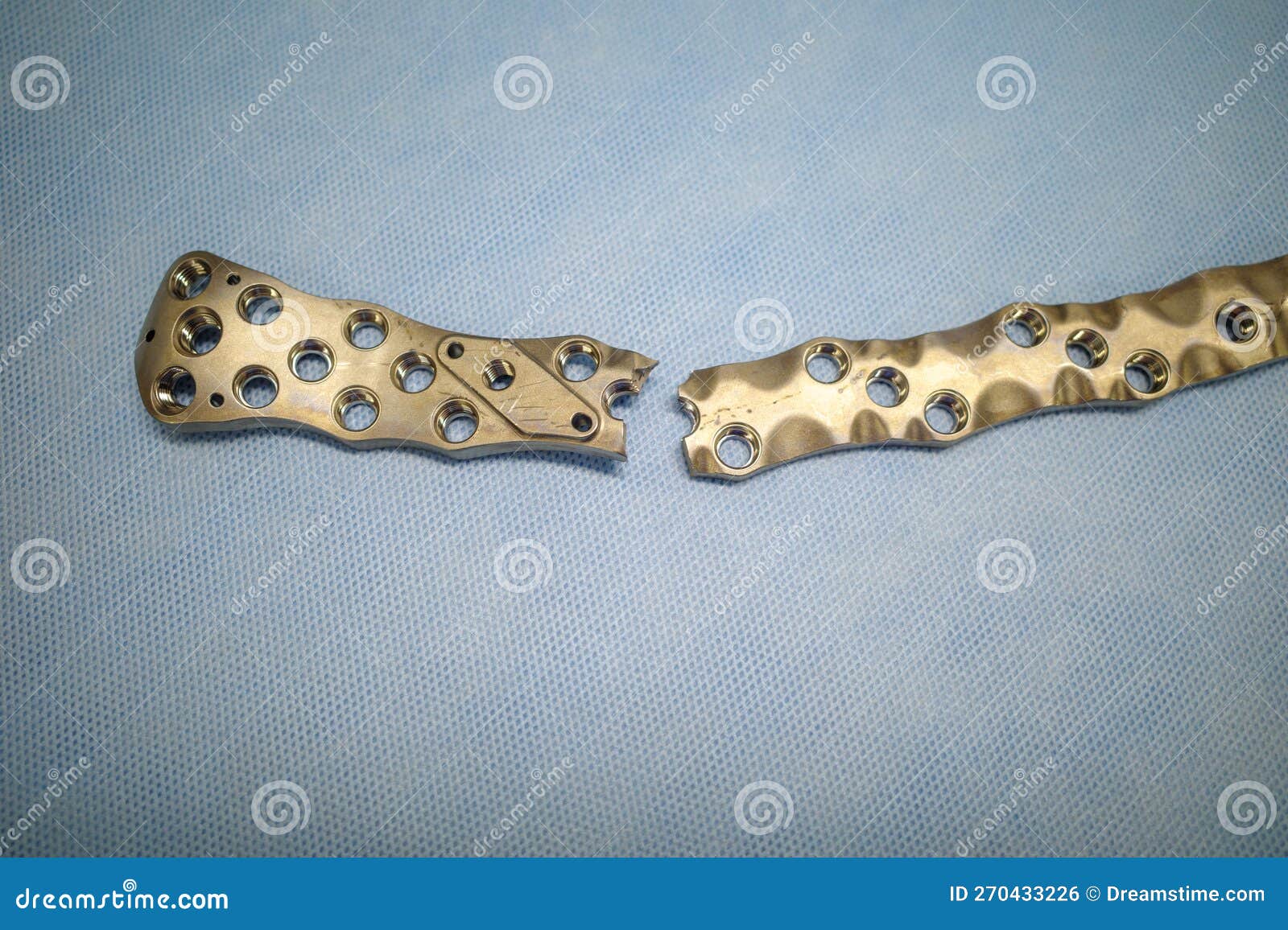 A Broken Titanium Plate Was Explanted in One Patient Stock Photo ...