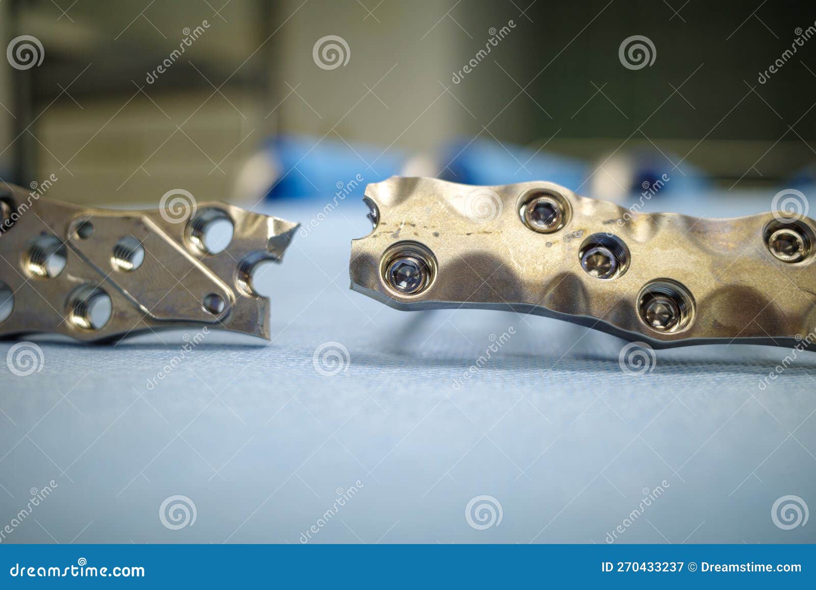 A Broken Titanium Plate Was Explanted in One Patient Stock Image ...