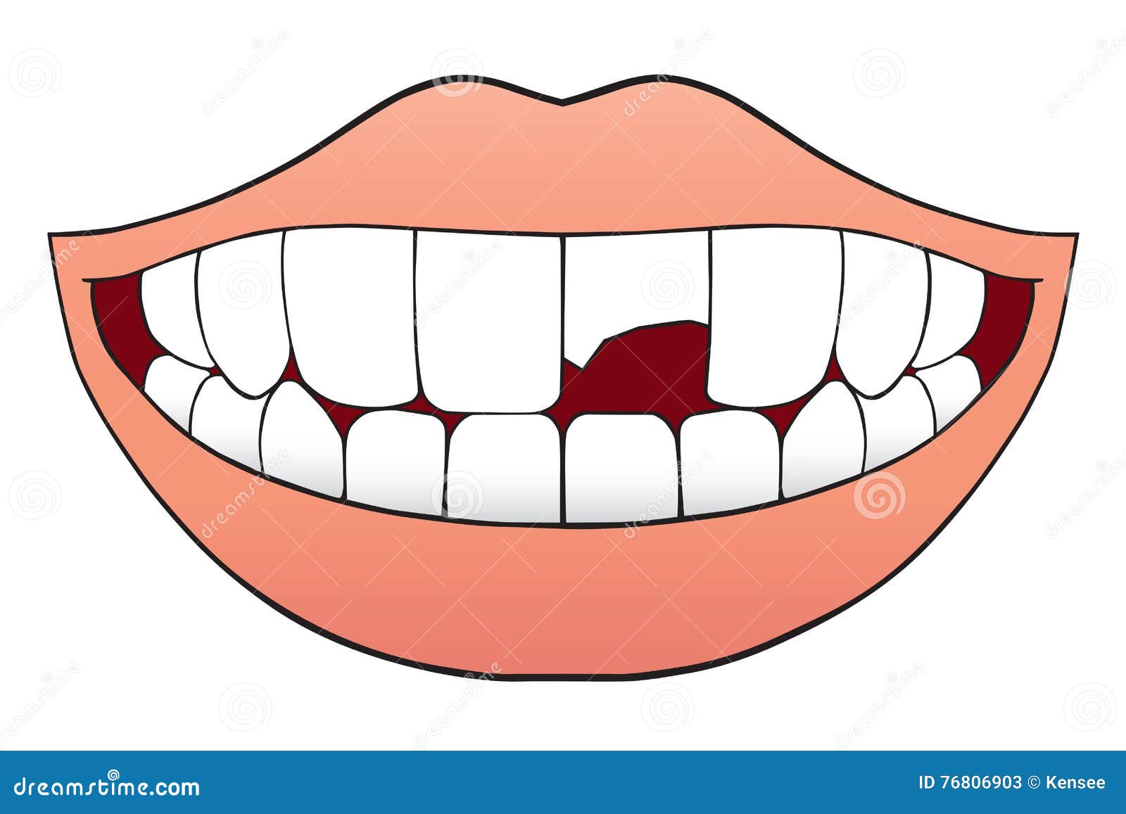 Broken Tooth stock vector. Illustration of cracked, distress - 76806903