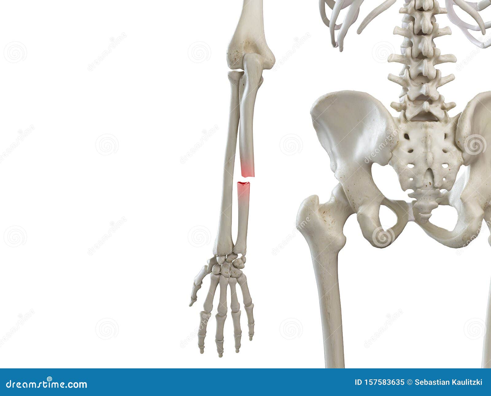 The Ulna Royalty-Free Illustration | CartoonDealer.com #57843705