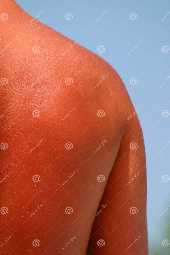 Bronceado detrás foto de archivo. Imagen de persona, verano - 247628