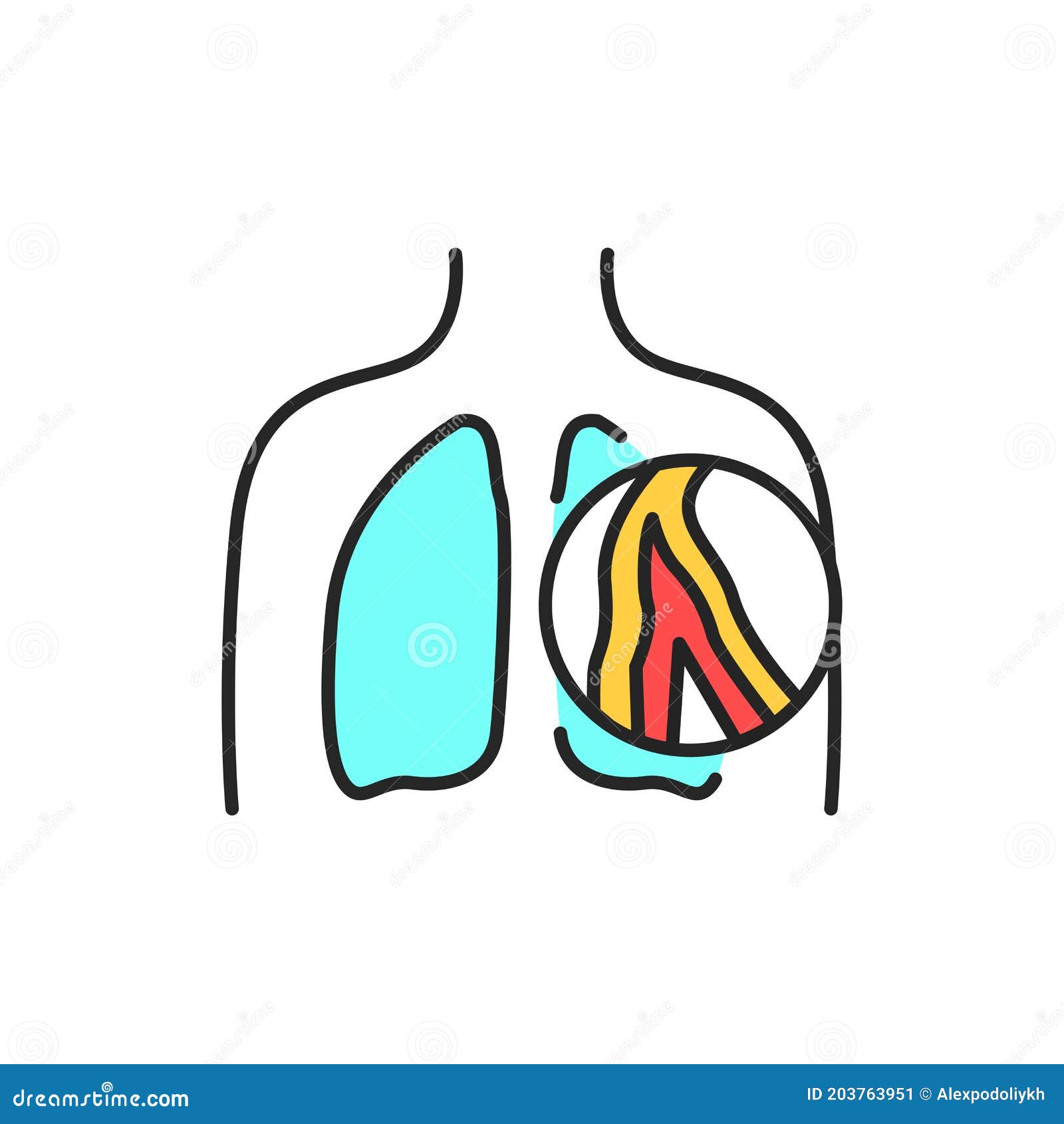 Bronchiectasis Line Color Icon. Sign for Web Page, Mobile App Stock ...