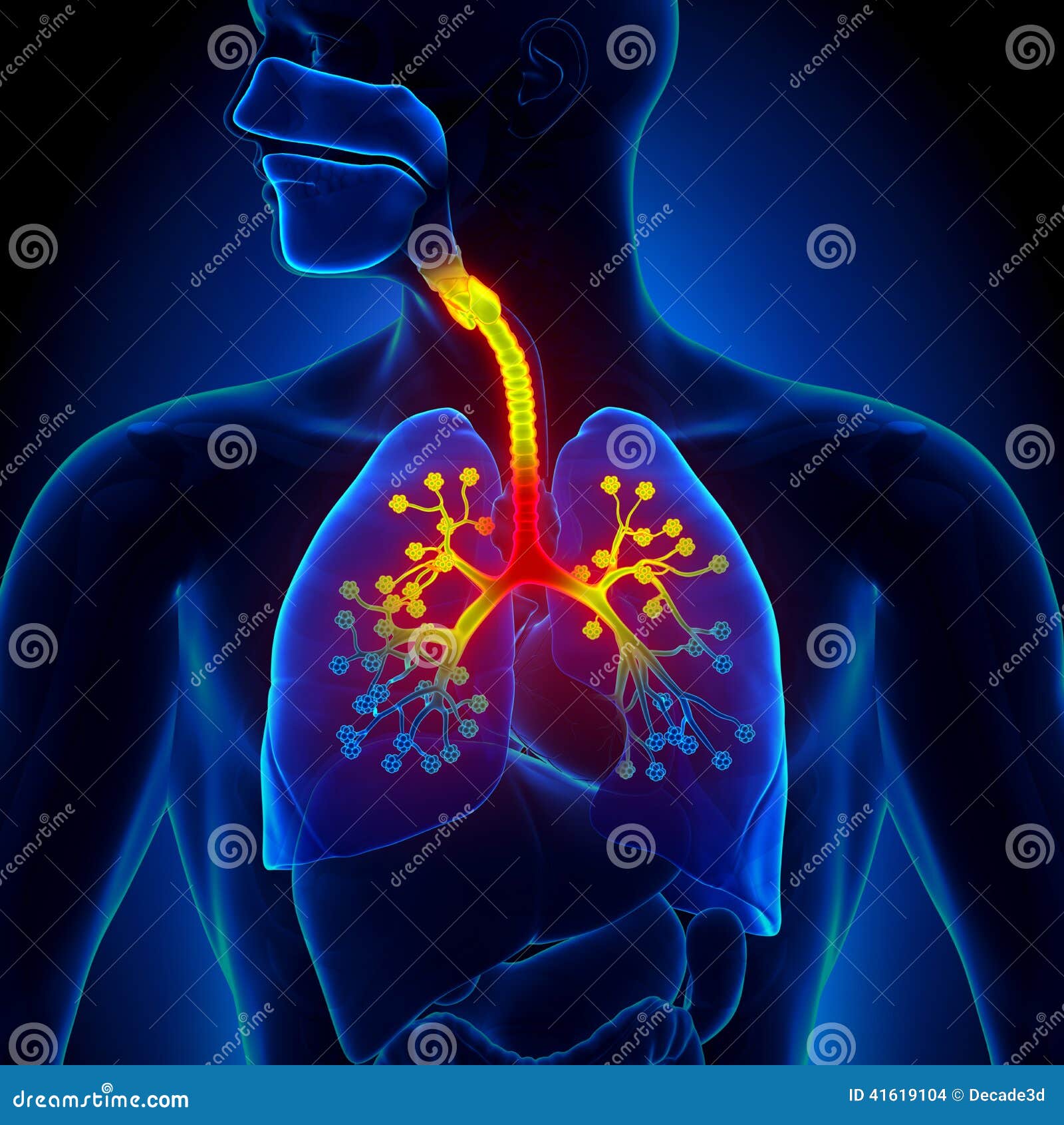 Bronchiolitis - Inflammation of the Bronchioles Stock Illustration ...