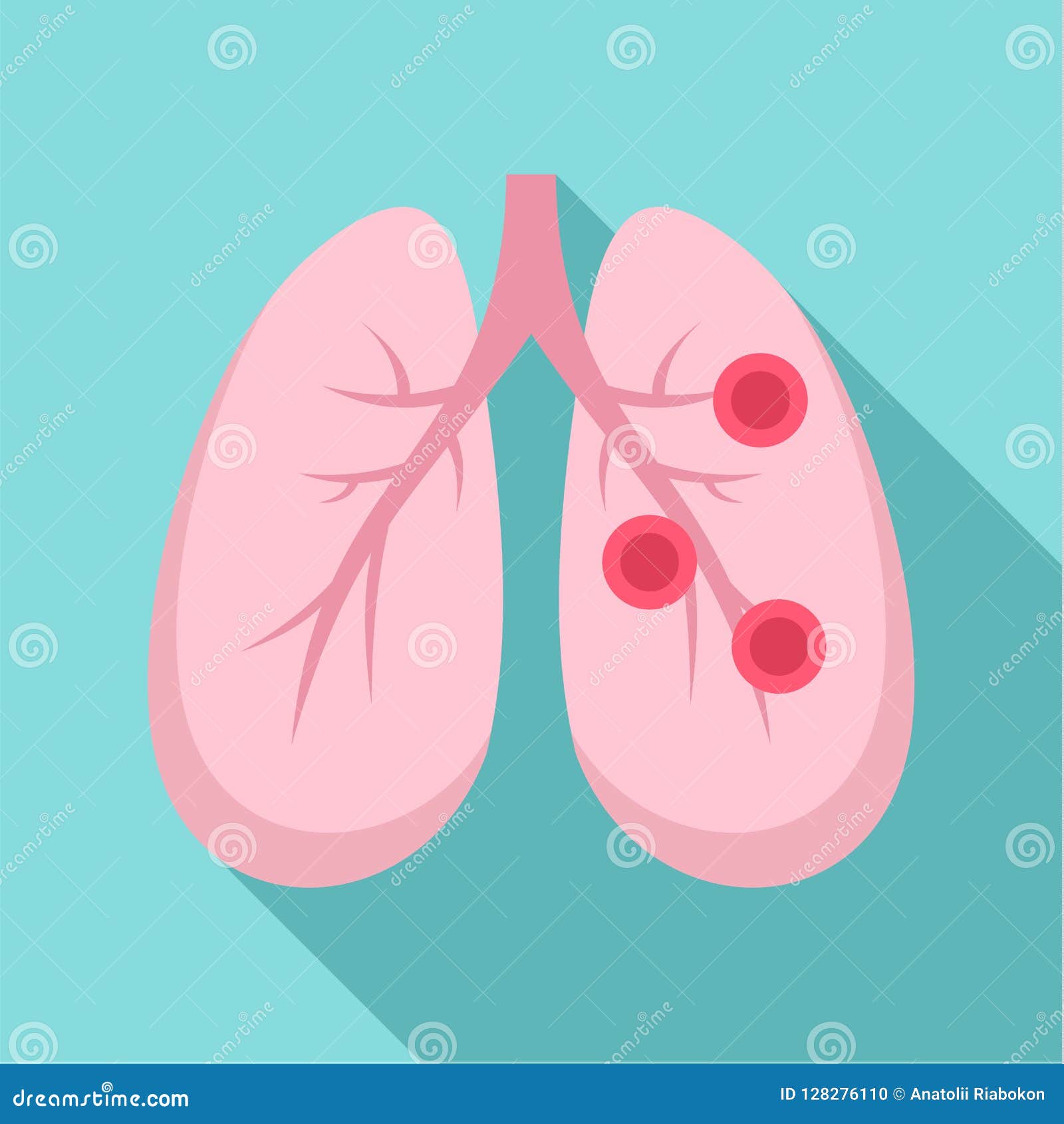 Bronchitis Lungs Icon, Flat Style Stock Vector - Illustration of chest ... Bronchitis Lungs Icon, Flat Style Stock Vector - Illustration of chest ...