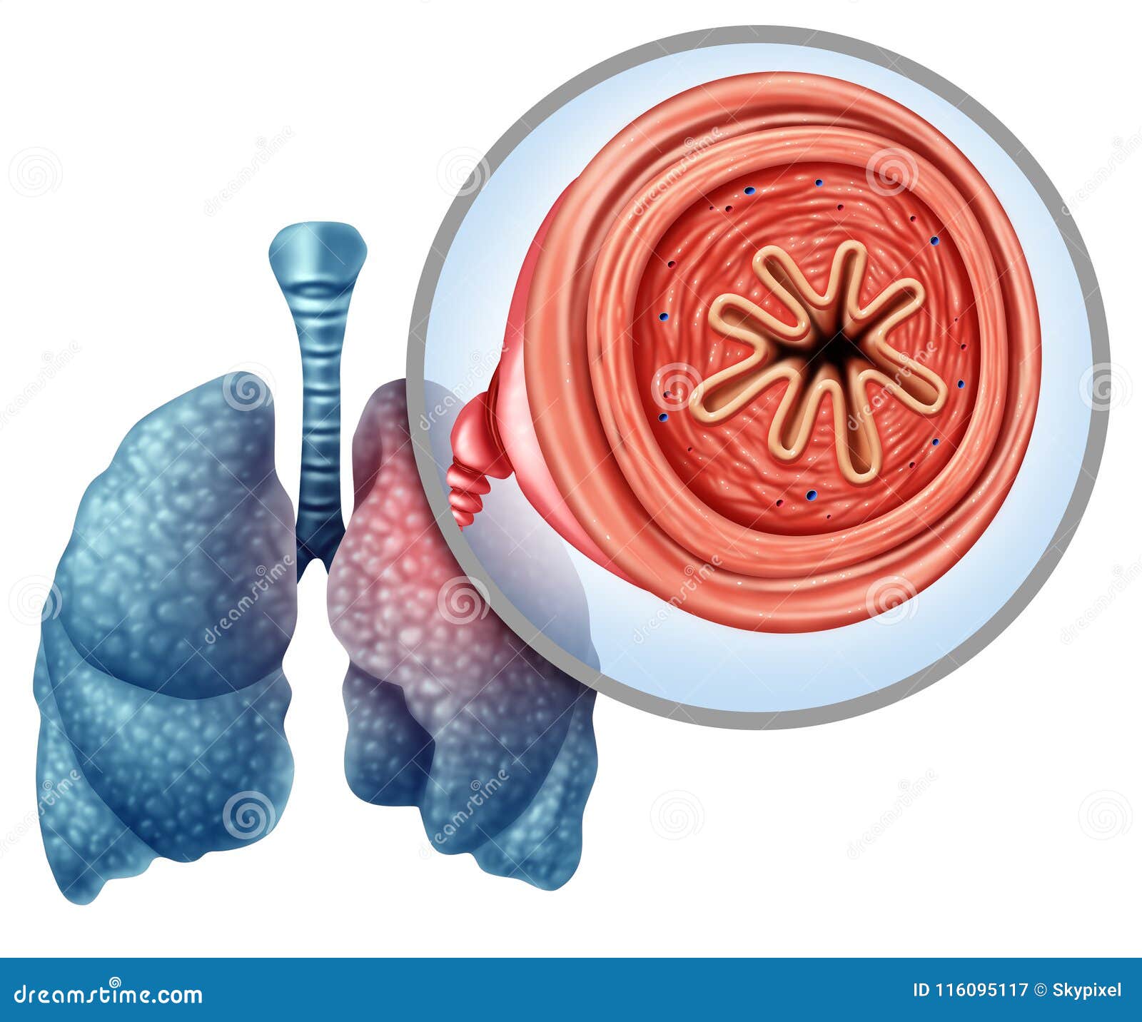 Bronchopneumopathie Chronique Obstructive De COPD Illustration Stock ...