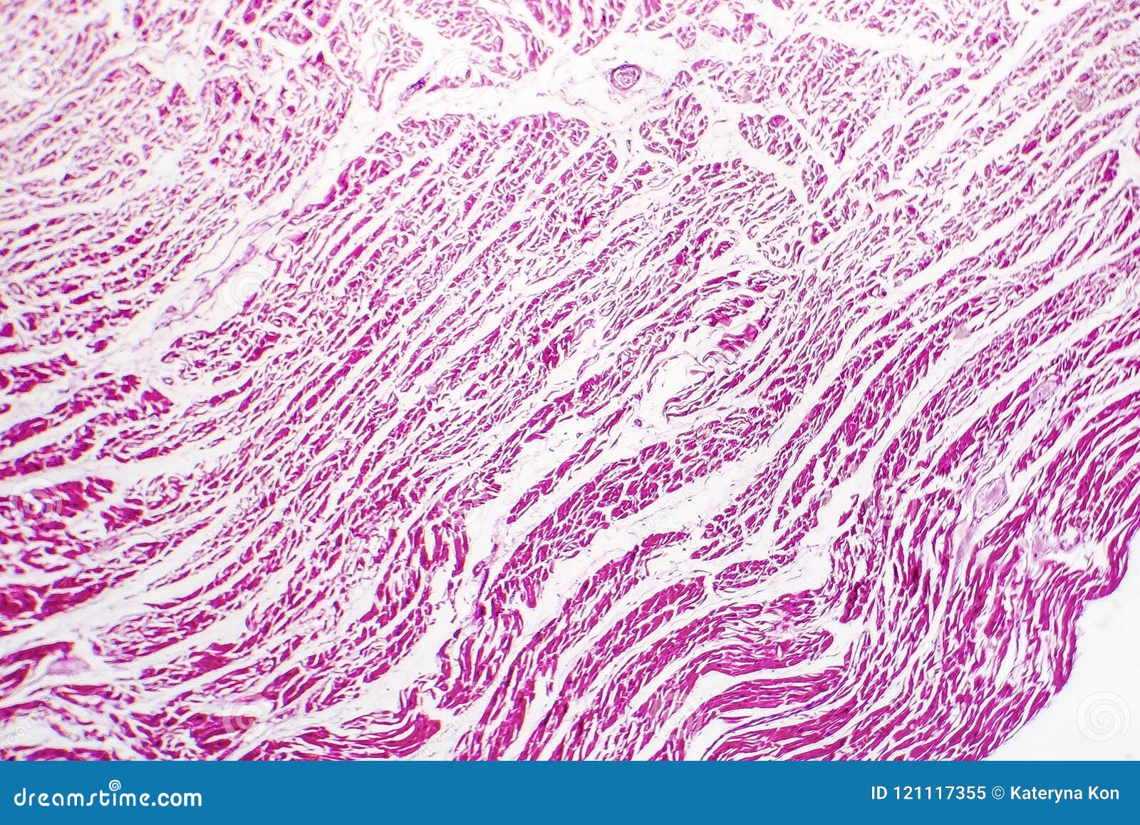 Brown Atrophy Of The Heart Royalty-Free Stock Image | CartoonDealer.com ...